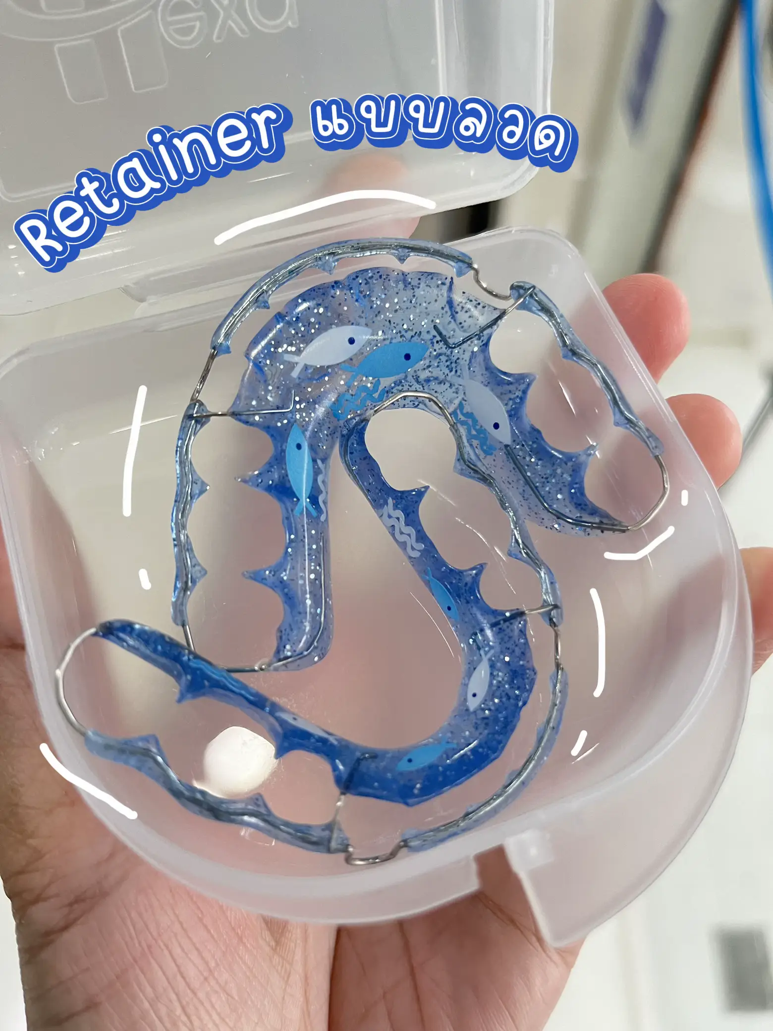 Retainer แบบลวด | แกลเลอรีที่โพสต์โดย pa_hrin | Lemon8