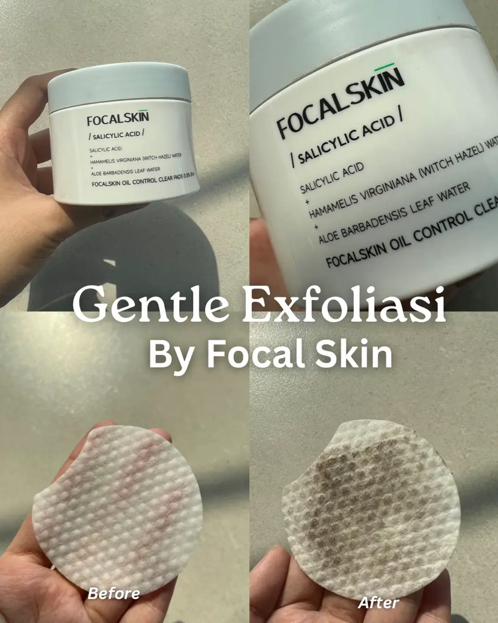18 ide Focalskin Clear Pad Review teratas di 2024