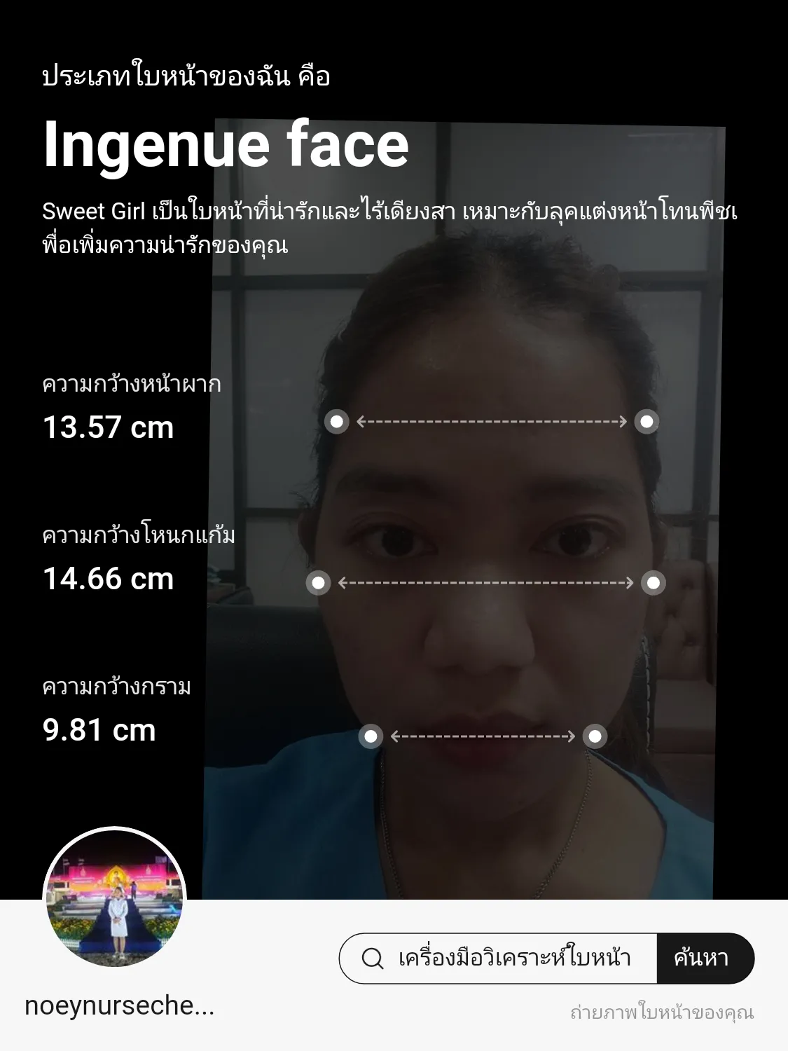 Report on the results of the face analysis. | Gallery posted by Noey Nurse Chee | Lemon8