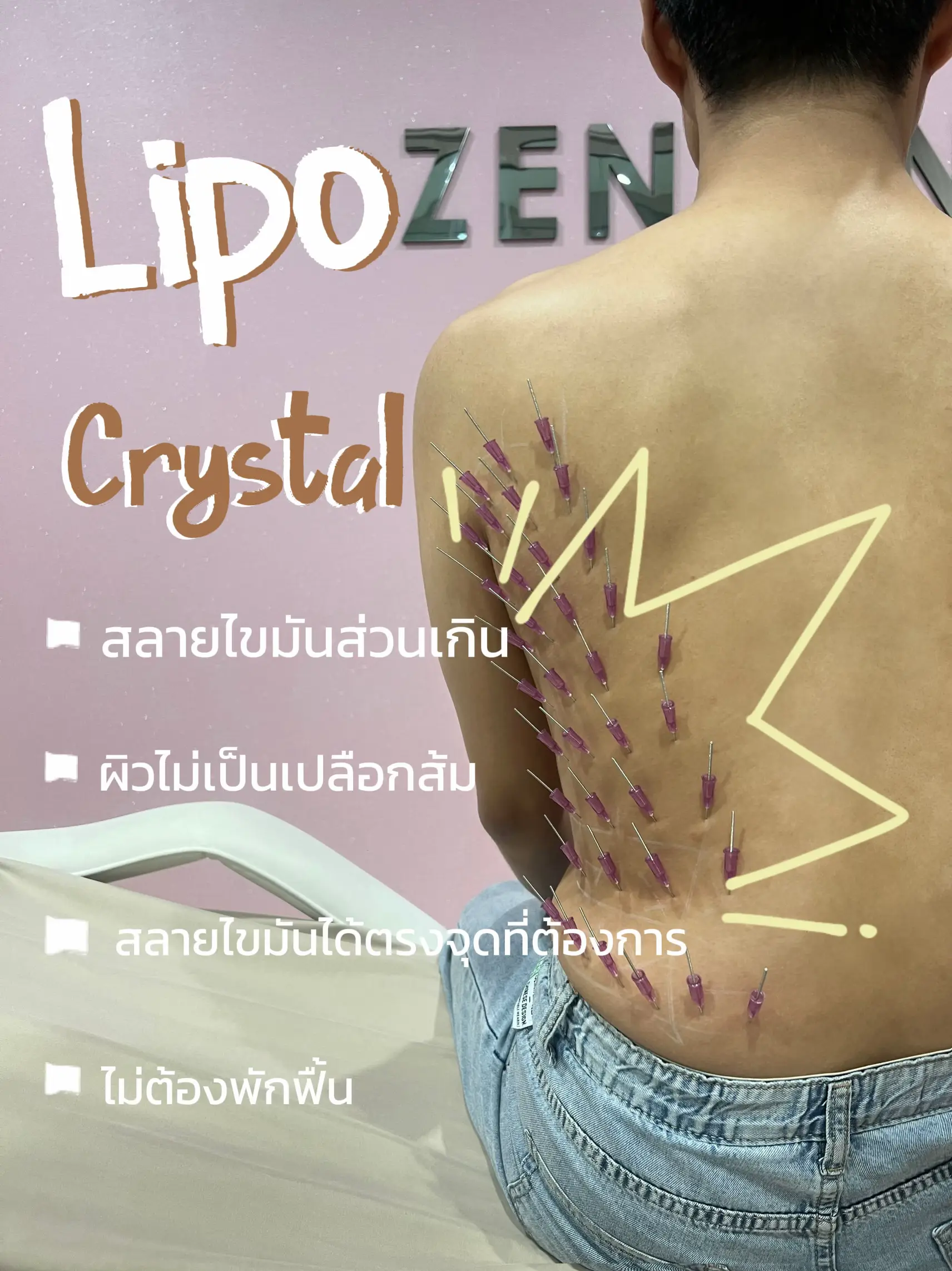 โปรเเกรม Lipo Crystal at Zenzen Clinic | แกลเลอรีที่โพสต์โดย ZENZEN ...