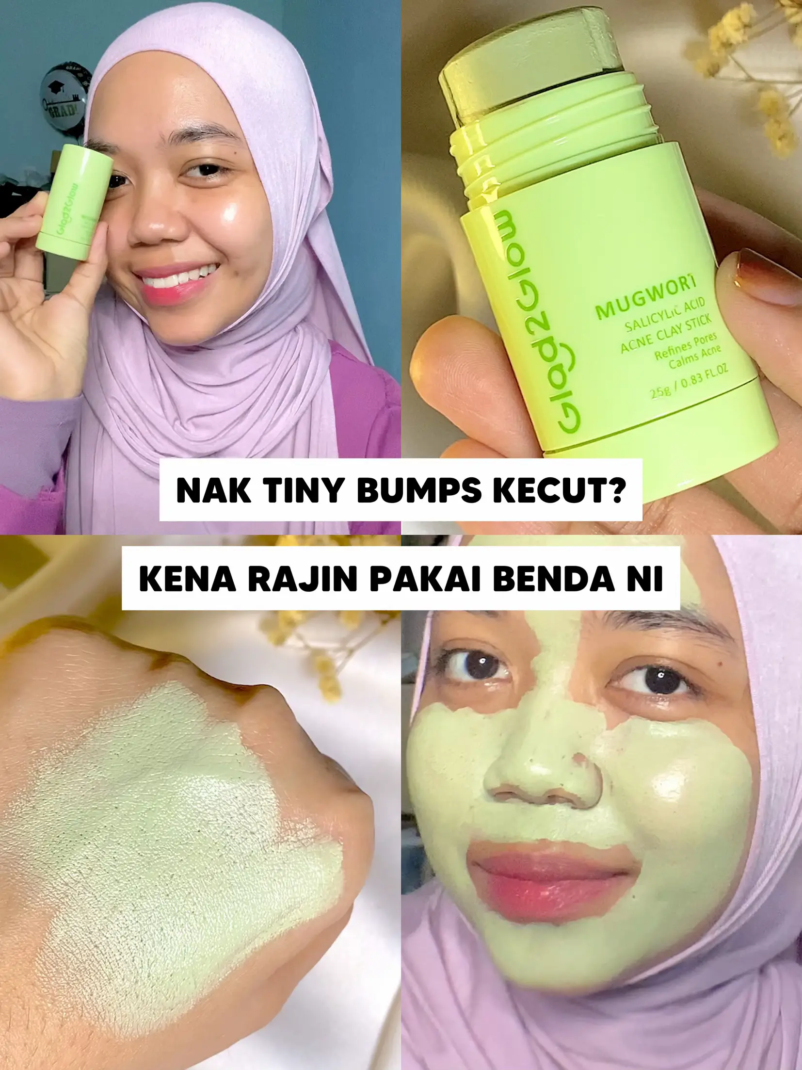 Patutlah tiny bumps cepat kecut >>> | Video diterbitkan oleh Aqish Beau Tips | Lemon8