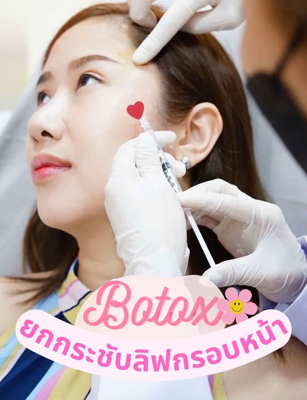 Botox ยกกระชับลิฟกรอบหน้า ! 😍 | แกลเลอรีที่โพสต์โดย maaneemeenaa | Lemon8
