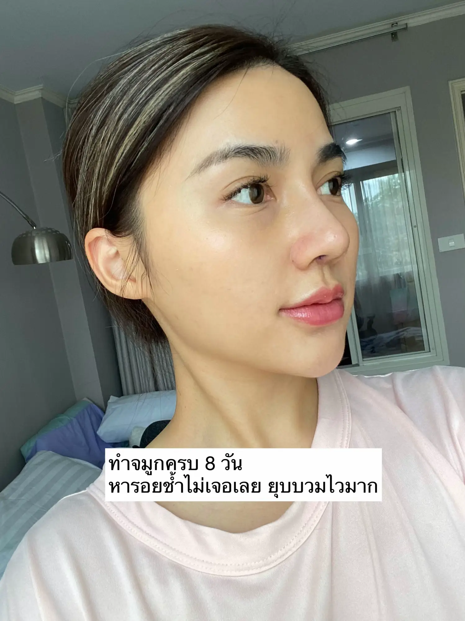 Includes must-have items. Helps reduce bruising swelling. After the ...