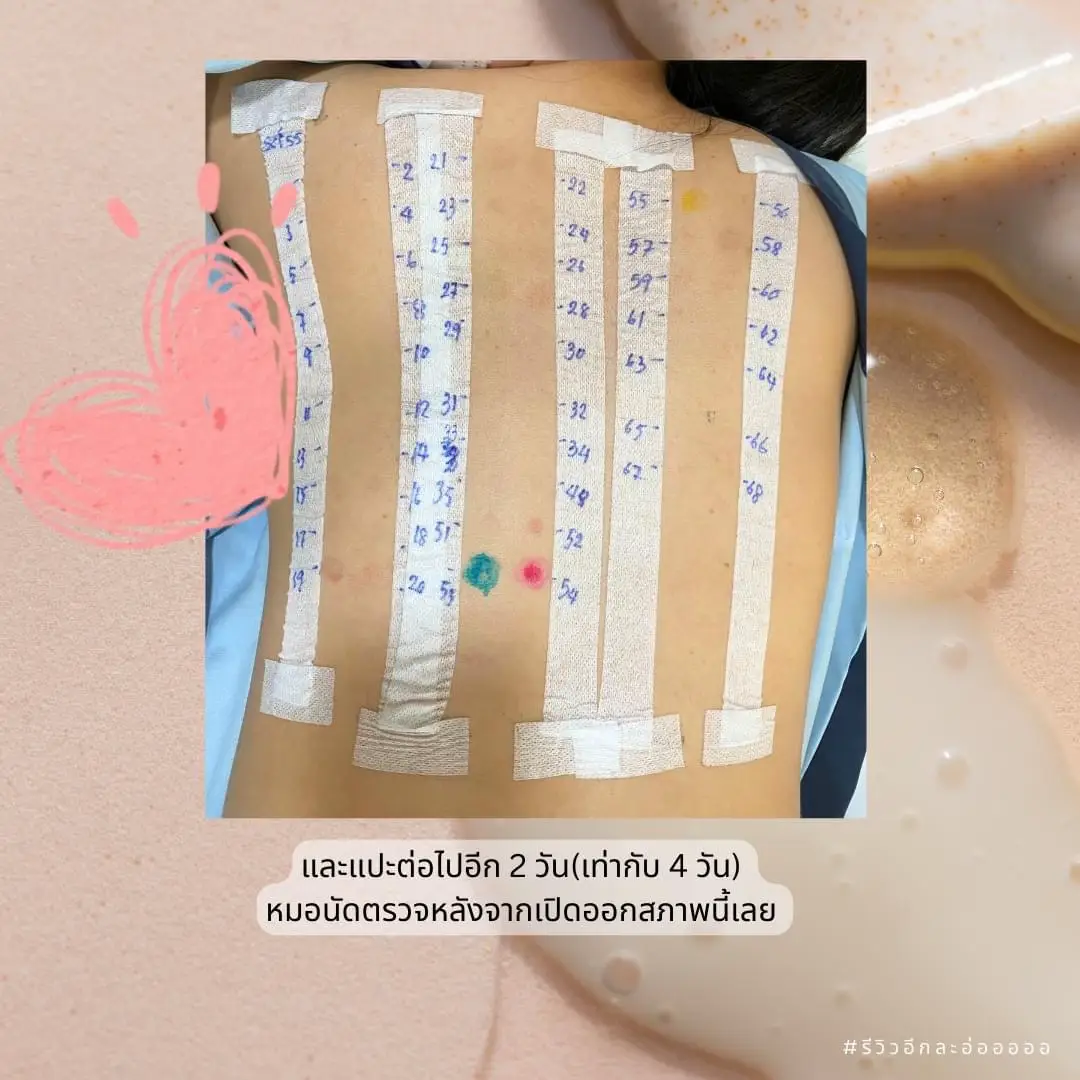 Patch test @โรงพยาบาลผิวหนัง อโศก🫶 | แกลเลอรีที่โพสต์โดย Jahchachuu 🫧 ...