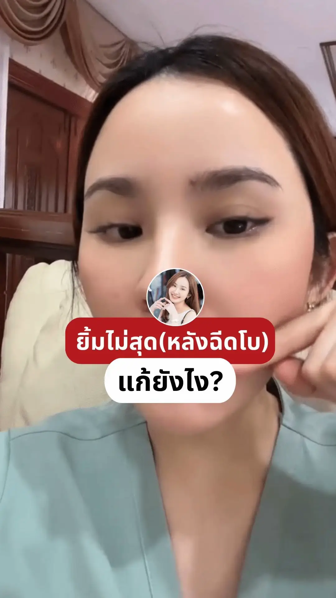 ยิ้มไม่สุด หลังฉีดโบ แก้ยังไง? | วิดีโอที่เผยแพร่โดย Thewika T. | Lemon8