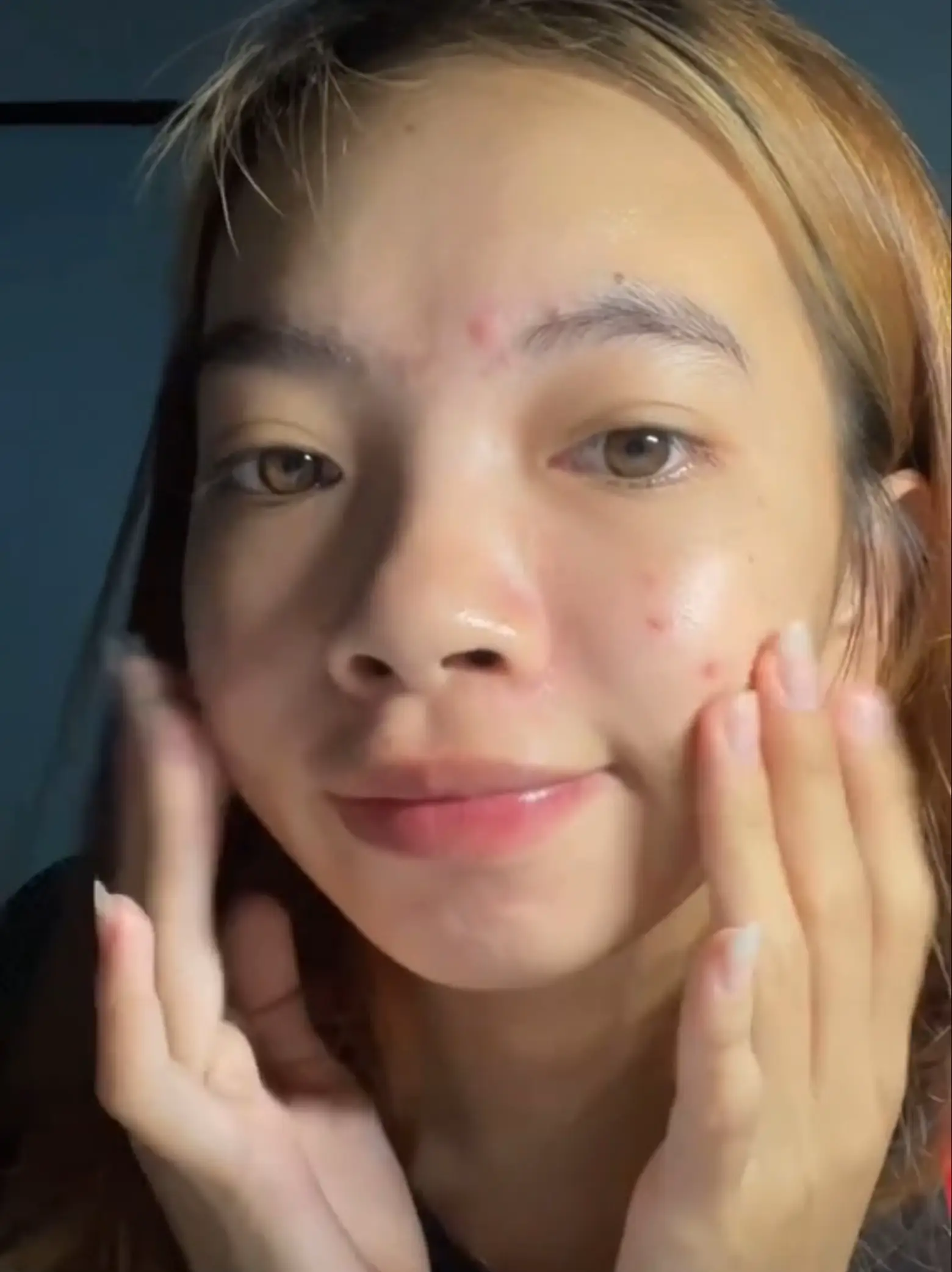 ทักกันมากใช่มั้ยใช้อะไรหน้าใส นี่เลย CosMD ไปลองกันรอไรละ | แกลเลอรีที่โพสต์โดย ป้ายยา | Lemon8