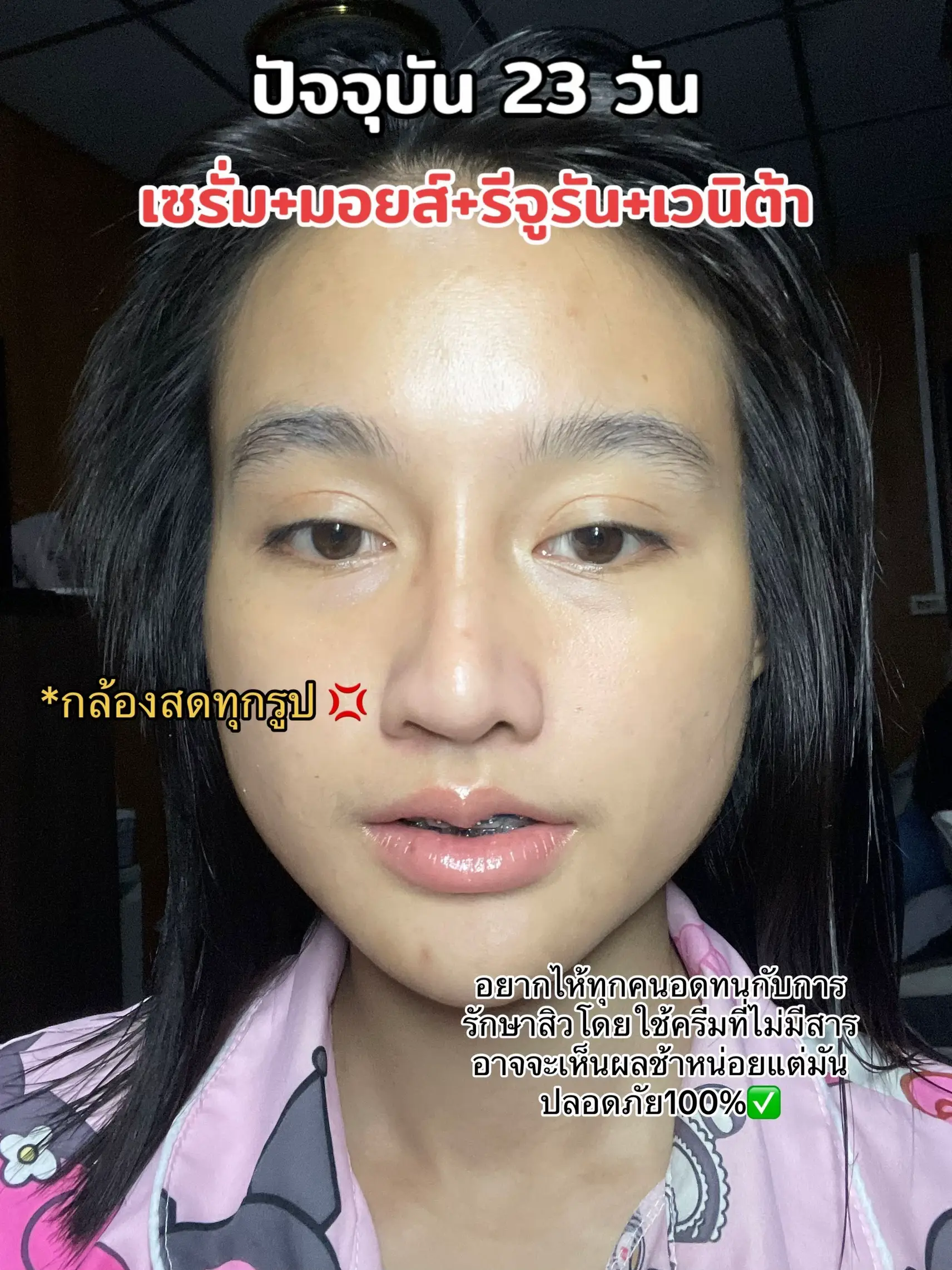 20 ไอเดียยอดนิยมเกี่ยวกับ ครีมรีจูรัน ดีไหม Pantip ในปี 2024