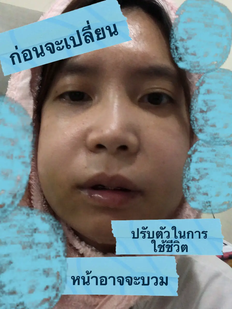 รีวิว😃 อายุใกล้ 40 จัดฟัน ยังทันไหม?? แล้วคอมเม้นท์ด้วยน๊าาา | แกลเลอรี ...