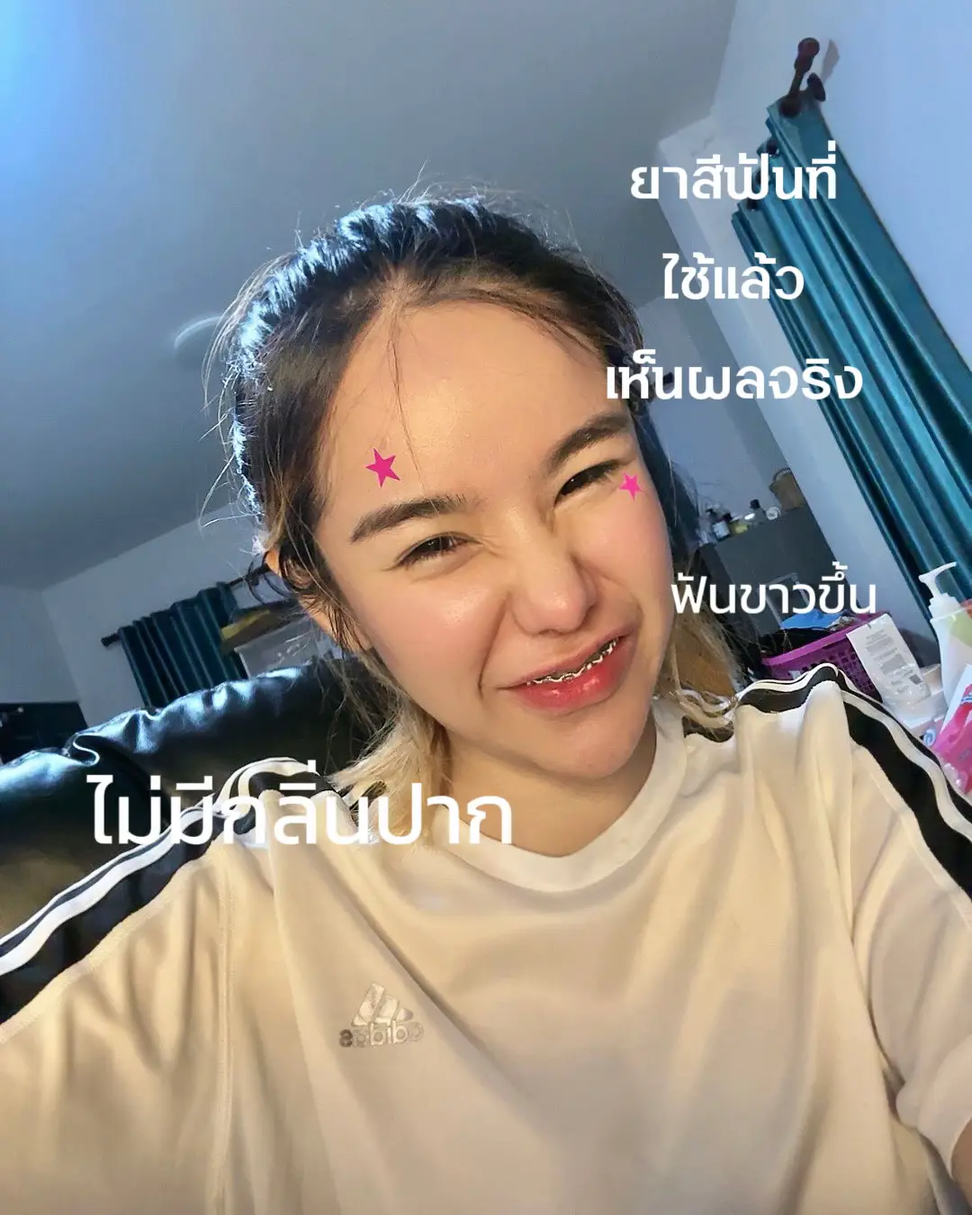 ยาสีฟันที่ใช้แล้วเห็นผลจริง | แกลเลอรีที่โพสต์โดย So'lo | Lemon8