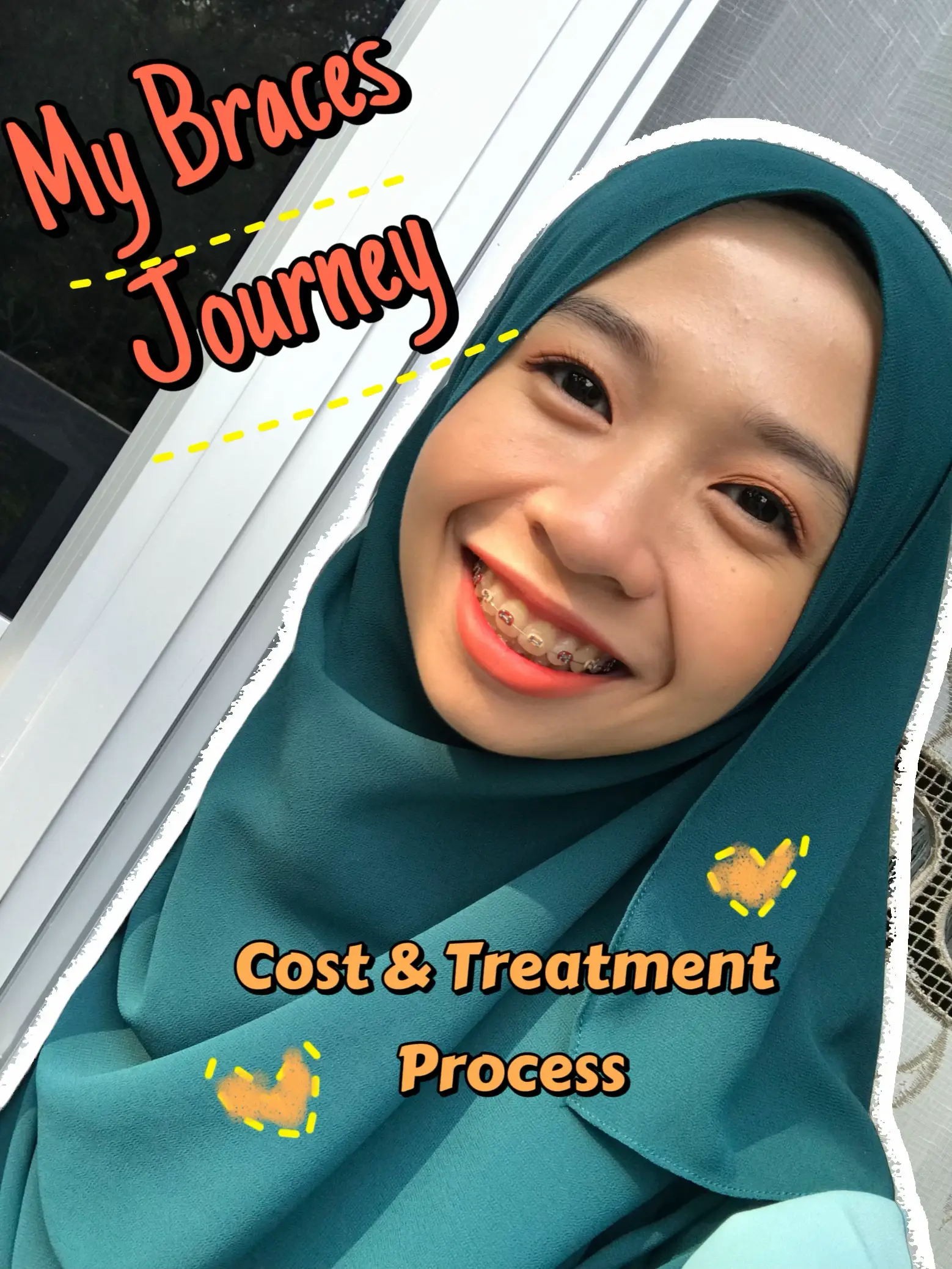 My Journey Getting Braces [ Cost & Process] | Galeri disiarkan oleh Jannah Anna | Lemon8