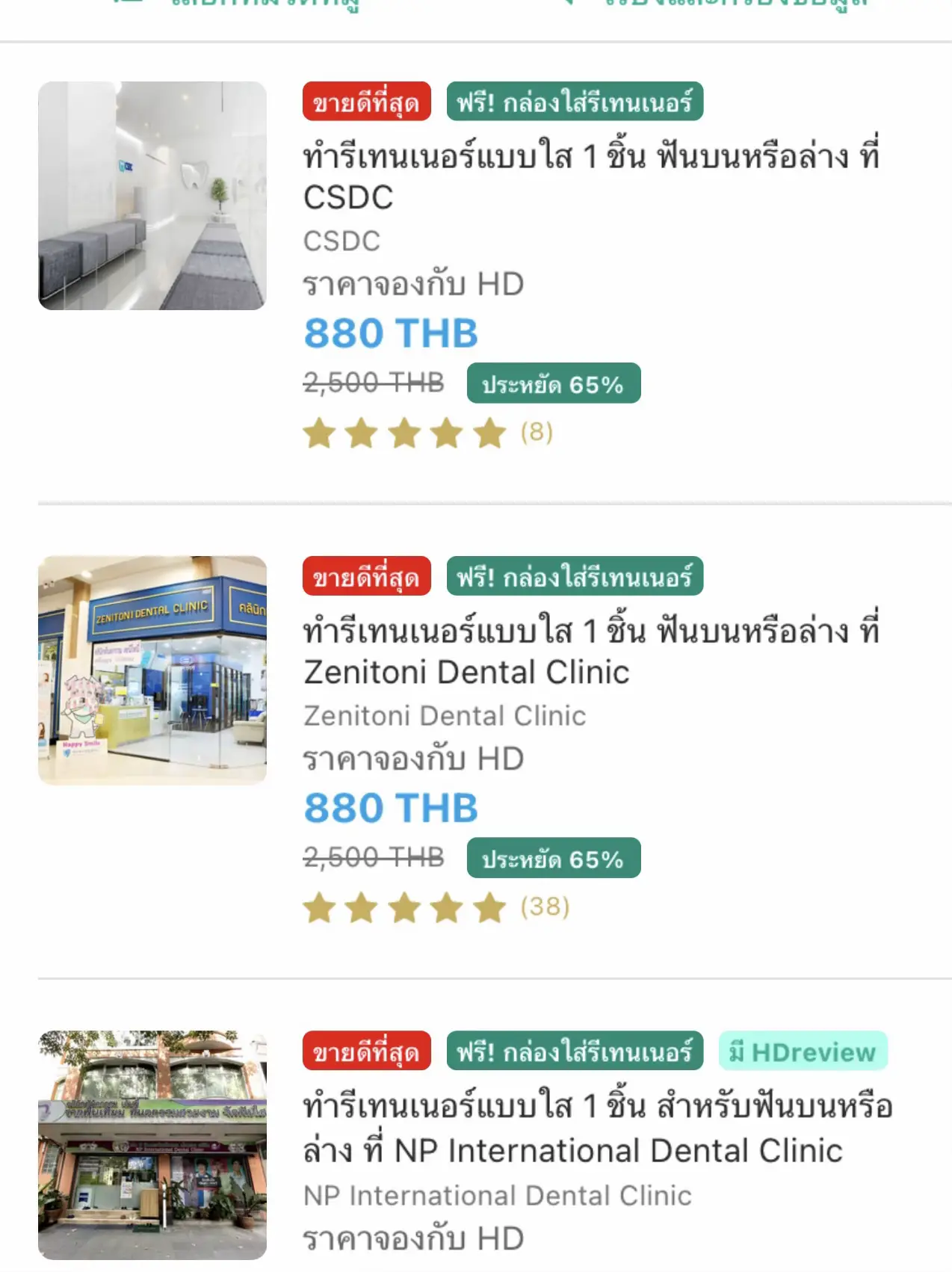 รีเทนเนอร์ | แกลเลอรีที่โพสต์โดย KWANJI | Lemon8