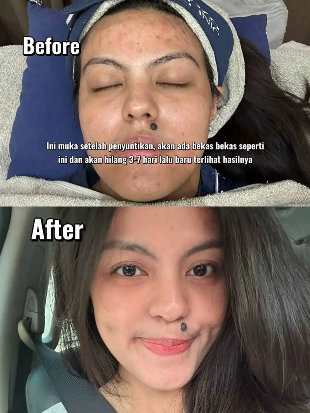 EXPERIENCE SALMON DNA! 🌞 | Galeri diposting oleh Shera Regina | Lemon8