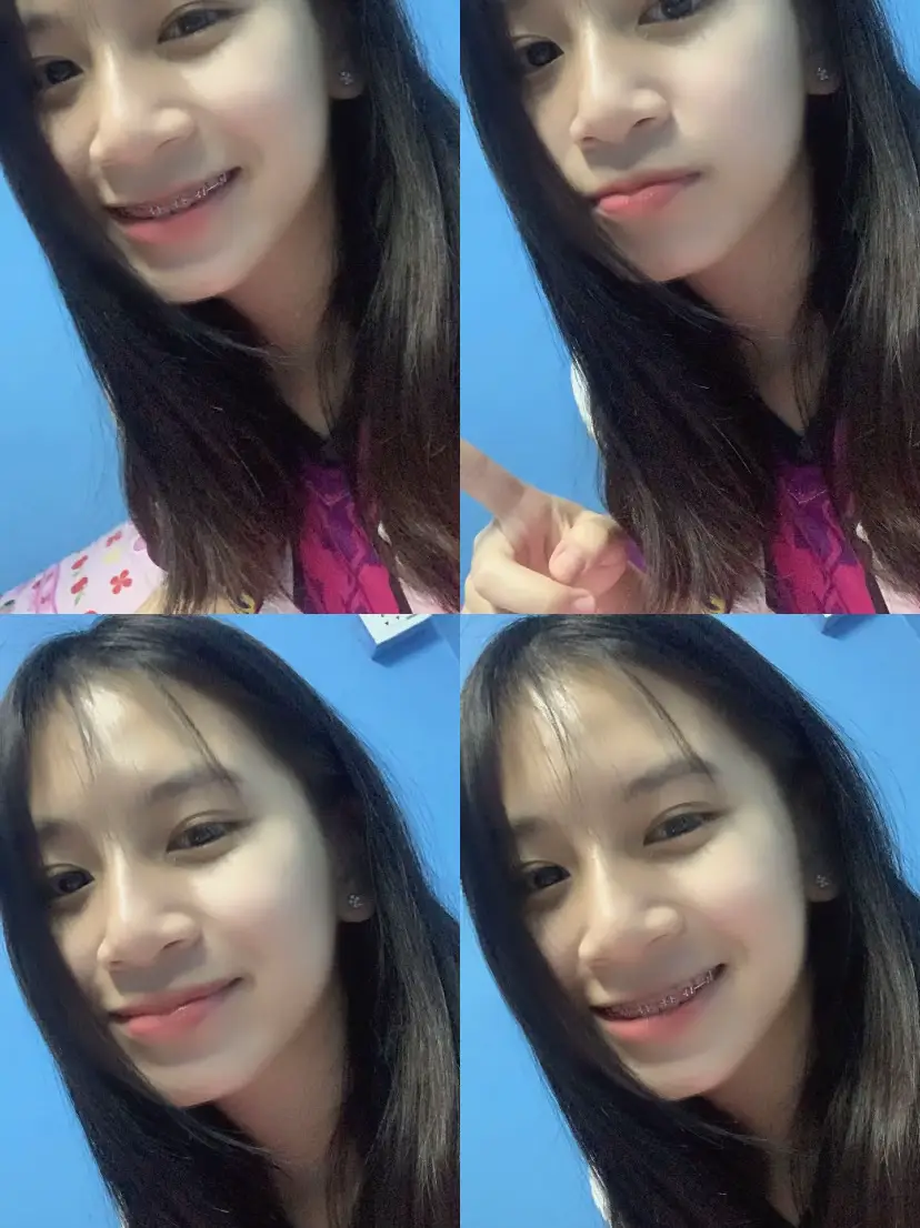 🍋🦷🎨มัดรวมสียางจัดฟัน ฉบับคนเลือกไม่ถูกแต่ออกมาส๊วยย;~;💐 | แกลเลอรีที่โพสต์โดย Namwan | Lemon8