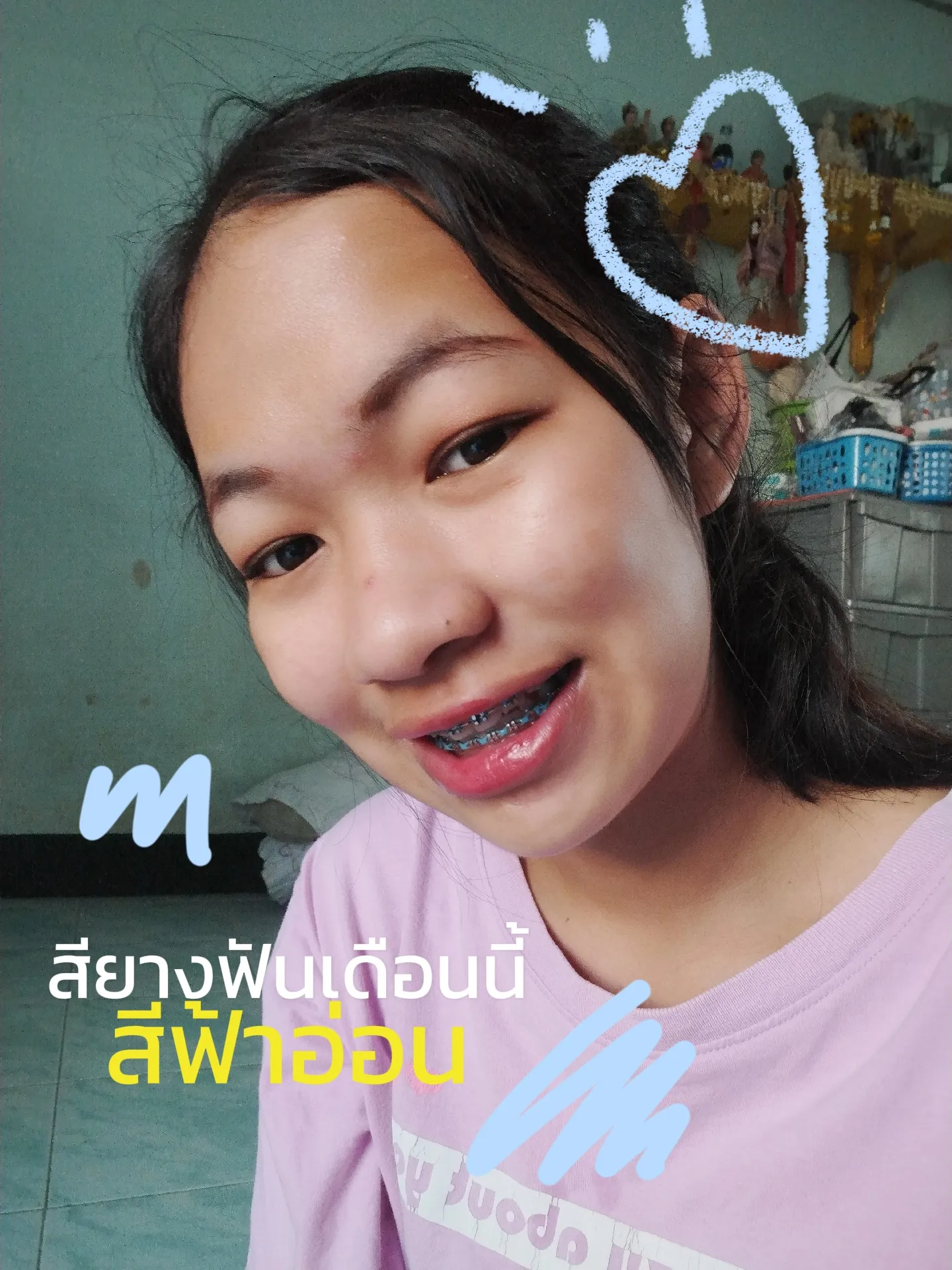 Tooth color this month. I like it very much.🩵 | Gallery posted by miew🌵 | Lemon8