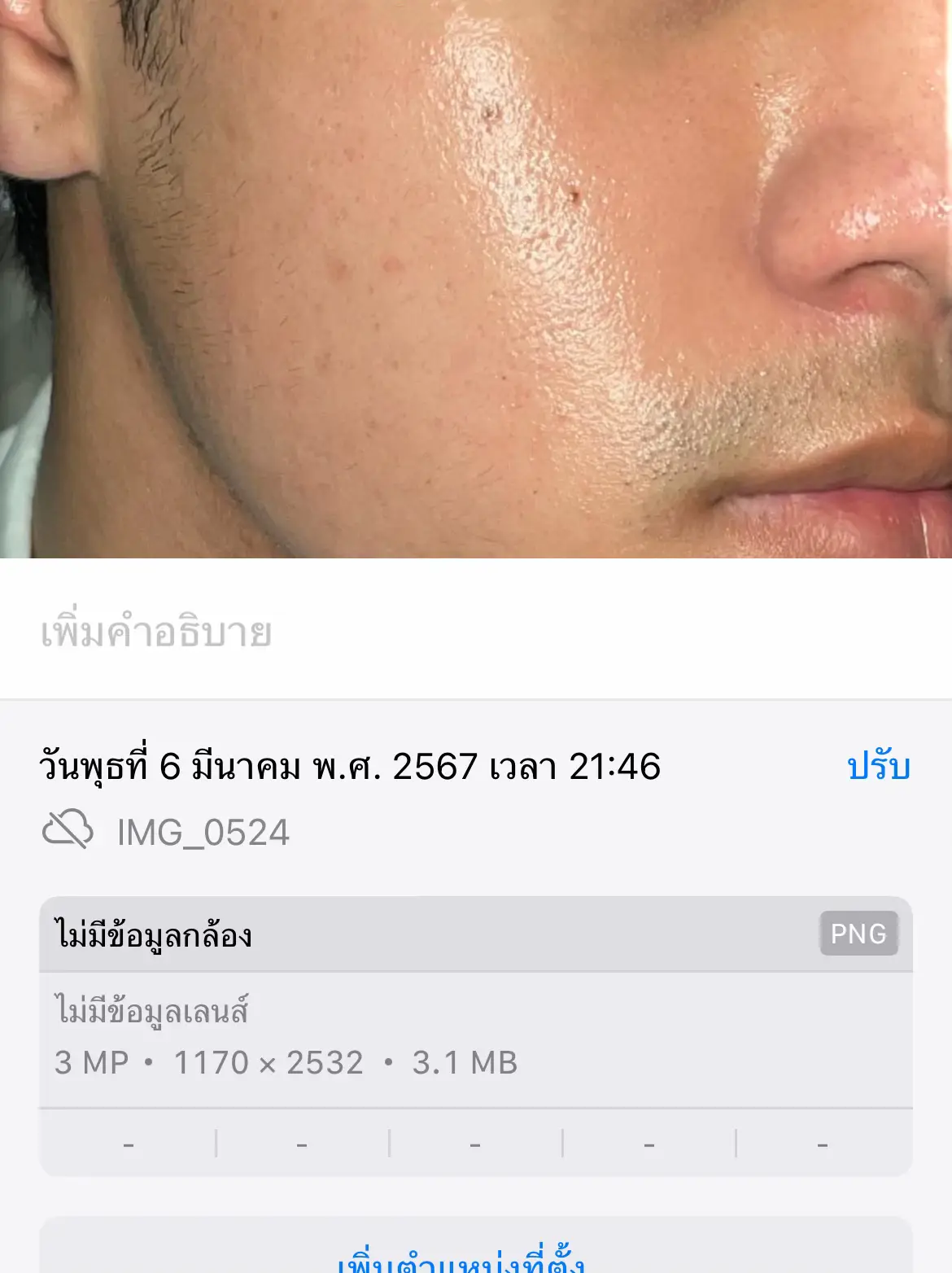 รักษาสิวด้วยตัวเอง ตามกำลังทรัพย์ | แกลเลอรีที่โพสต์โดย Ins_pire | Lemon8