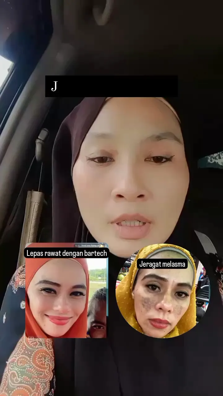 JERAGAT KRONIK | Video diterbitkan oleh Oya_Bartech | Lemon8