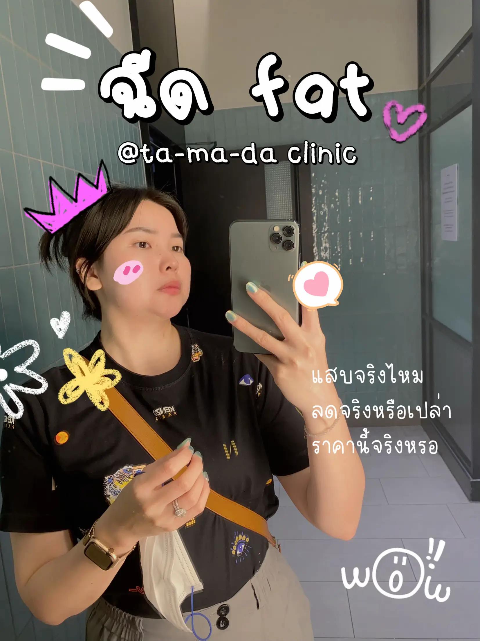 รีวิวฉีด fat ราคา 299 บาท!?🫧😭 | วิดีโอที่เผยแพร่โดย Jarenspd | Lemon8
