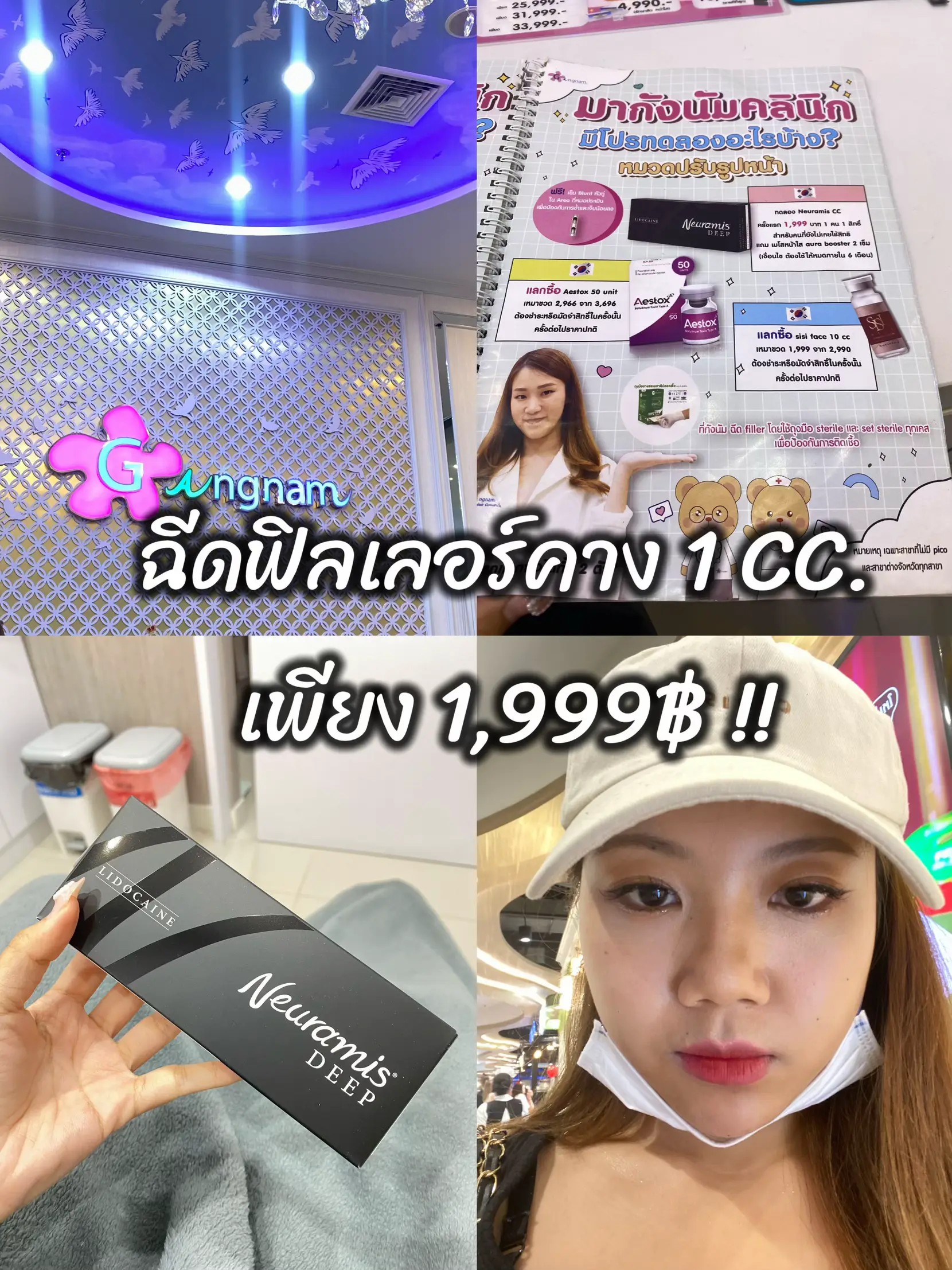 ฉีดฟิลเลอร์คาง Neuramis 1 cc. ครั้งแรก 👏 | แกลเลอรีที่โพสต์โดย Papang ... ฉีดฟิลเลอร์คาง Neuramis 1 cc. ครั้งแรก 👏 | แกลเลอรีที่โพสต์โดย Papang ...