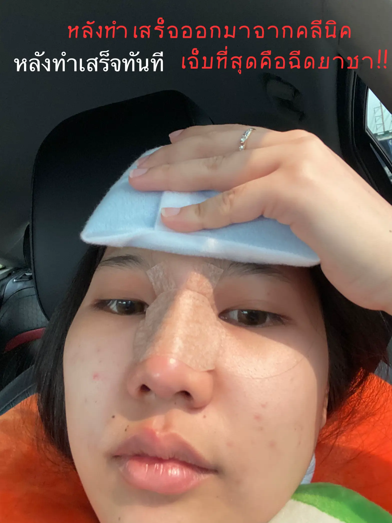 ประสบการณ์ทำจมูกครั้งแรก👃🏻 | แกลเลอรีที่โพสต์โดย Yns. | Lemon8