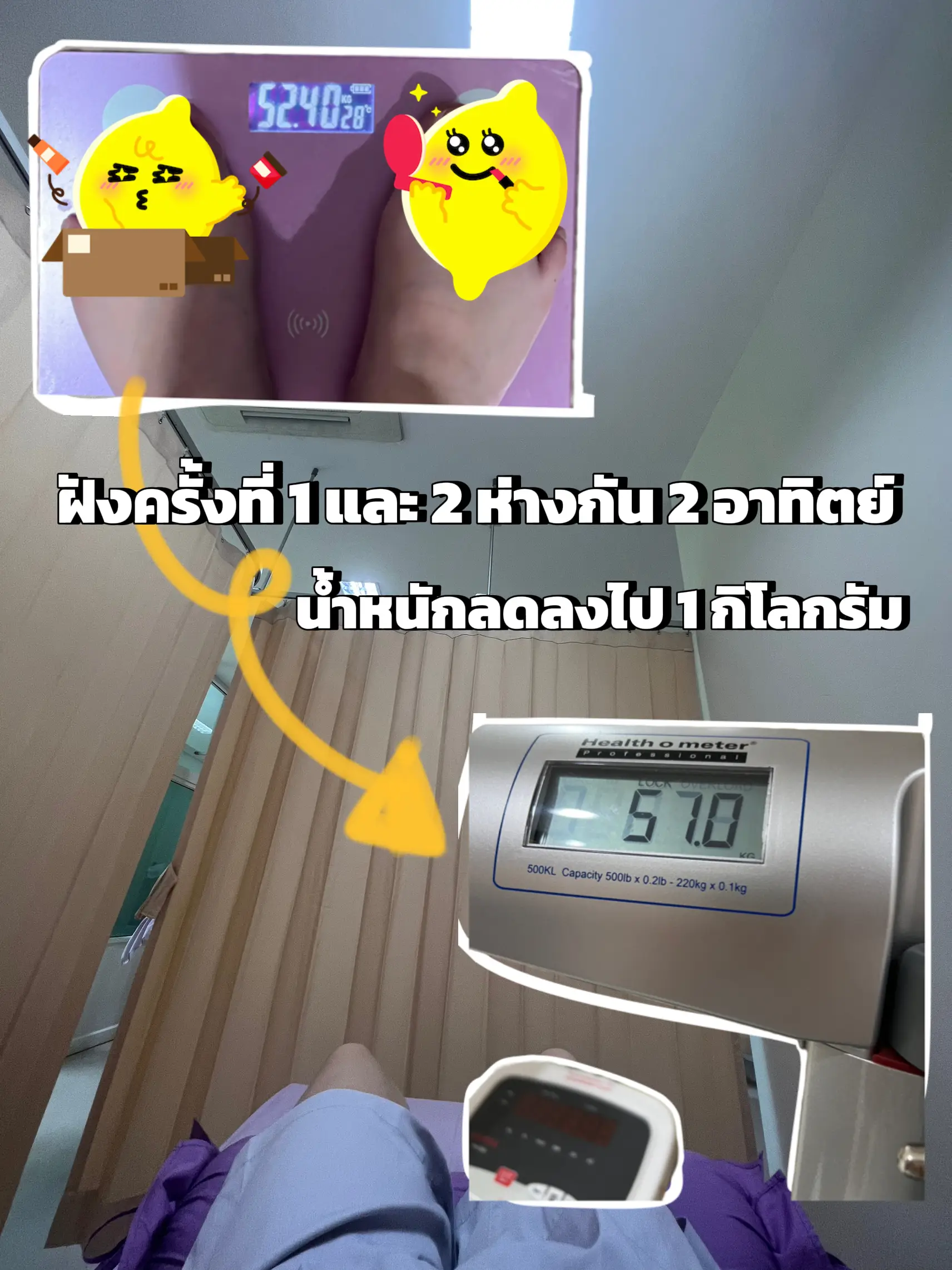 ฝังเข็มลดน้ำหนัก | แกลเลอรีที่โพสต์โดย Pia Ser | Lemon8