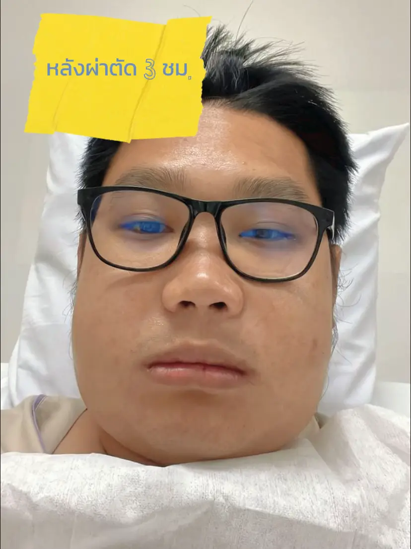 รีวิวผ่าขากรรไกร ที่คณะทันตแพทย์ ม.มหิดล 🦷 | แกลเลอรีที่โพสต์โดย M ...