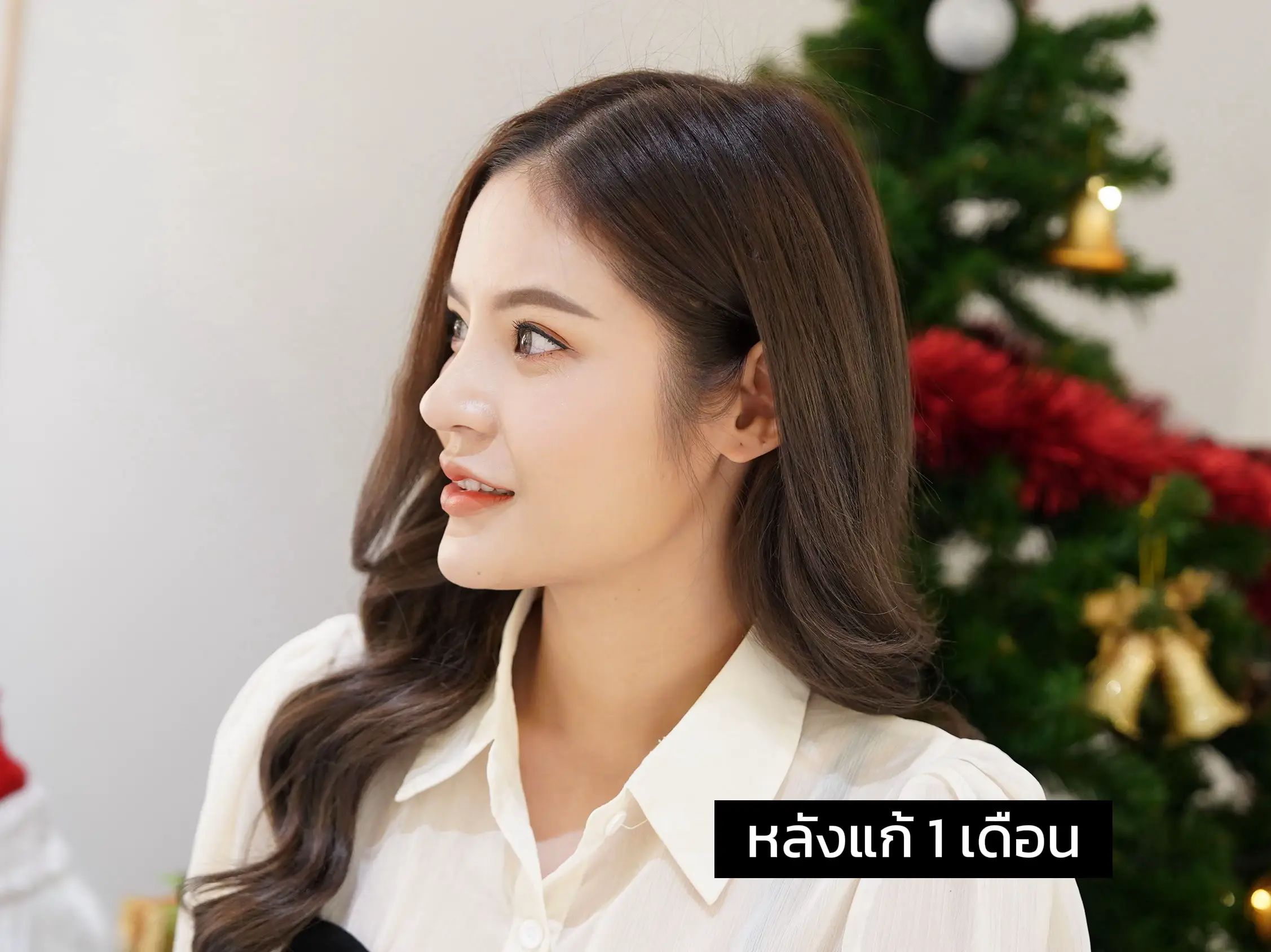 SEMI-OPEN SSTP 4-MONTH NUM REVIEW | Gallery posted by วินเซนต์พารีวิว | Lemon8