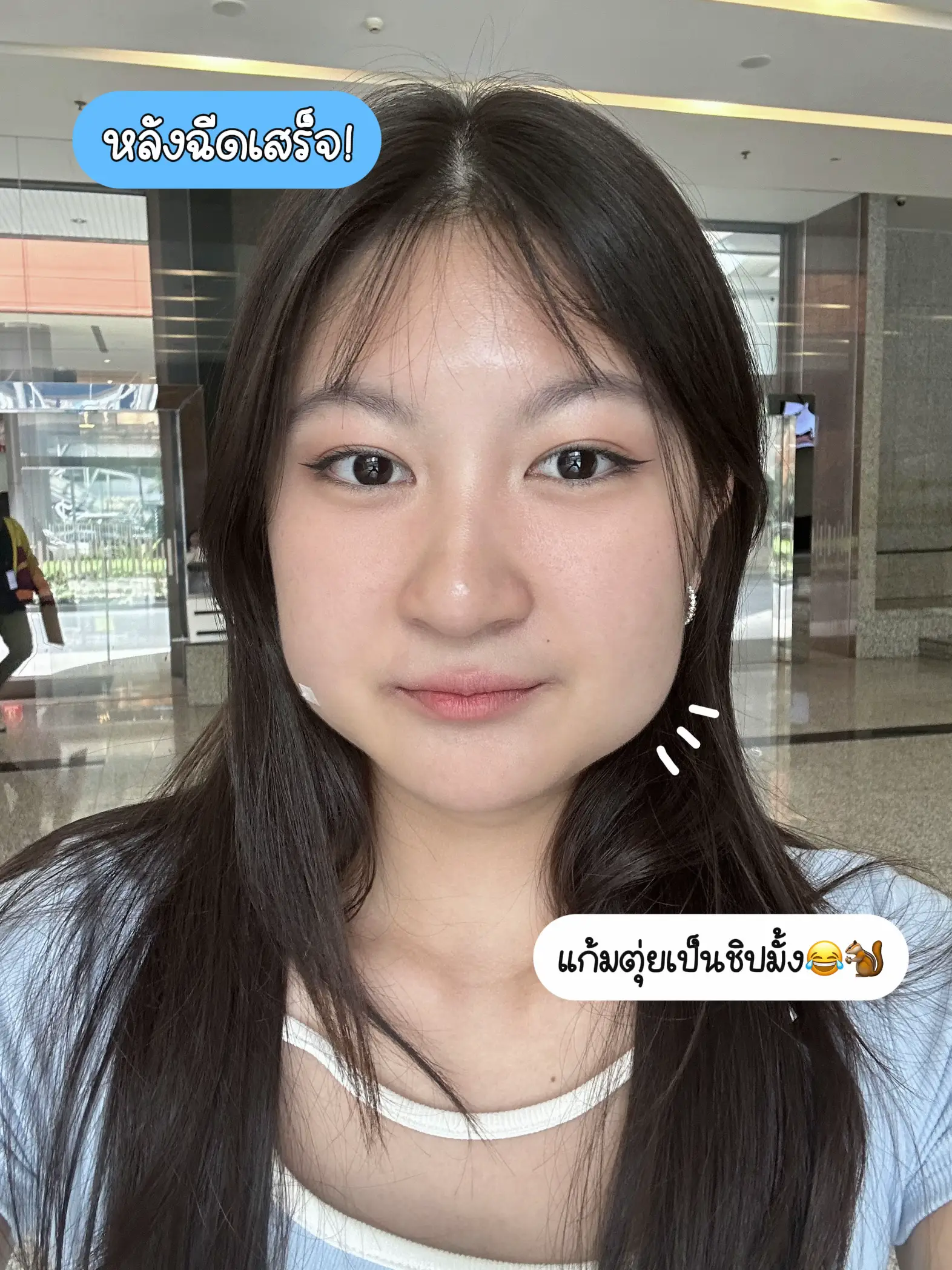 ฉีดหน้าครั้งแรกในชีวิต ปังแค่ไหน 🤩⁉️ | แกลเลอรีที่โพสต์โดย saavee | Lemon8