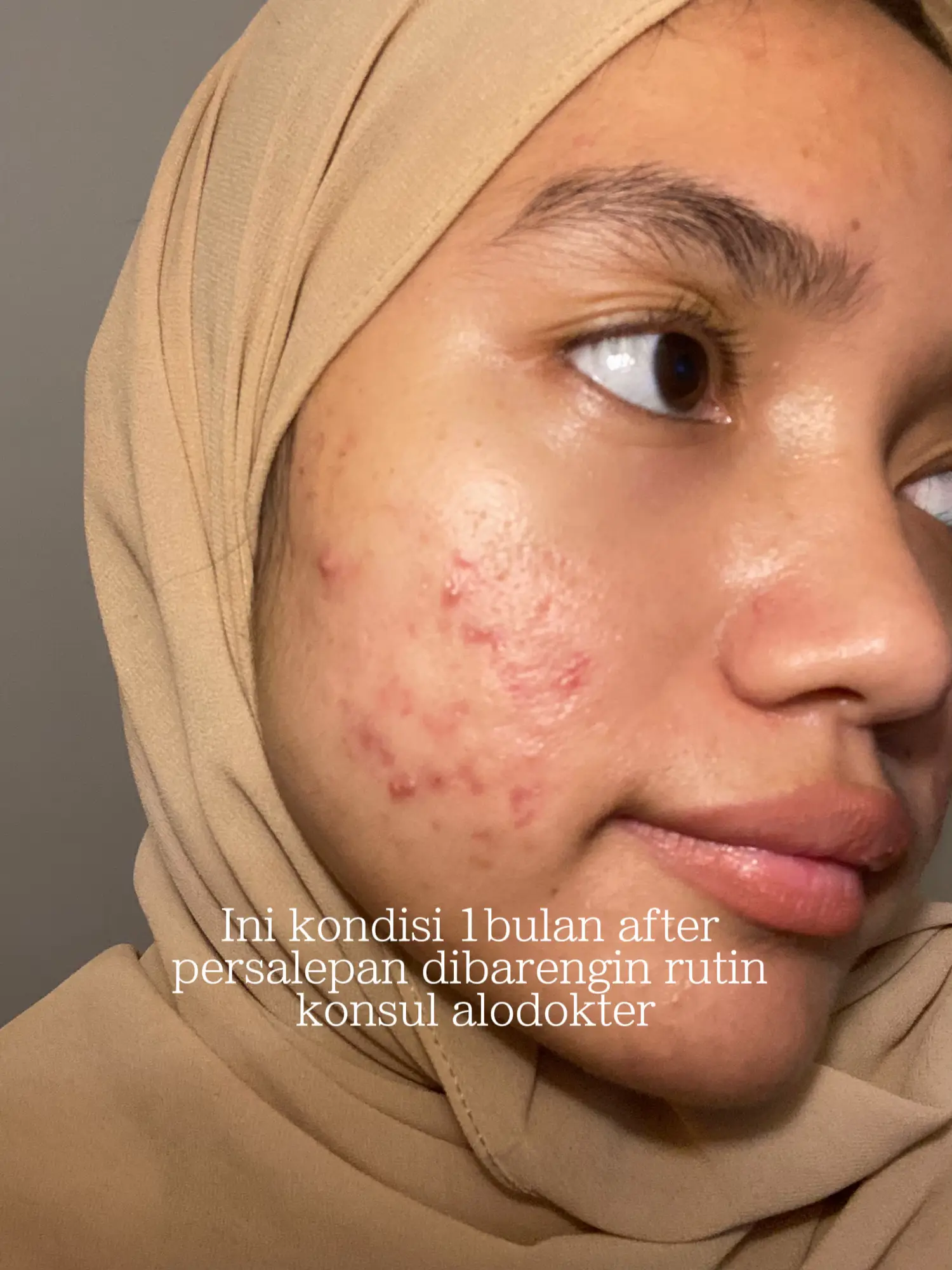 PAKE SALEP TAPI PURGING??JANGAN PANIK!! | Galeri diposting oleh Maudii ...