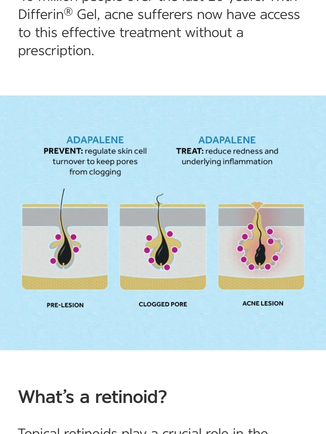 PIMPLE FACE ️ CLEAR SKIN! 6 months update! | Gallery posted by piscesmoon🌜 | Lemon8