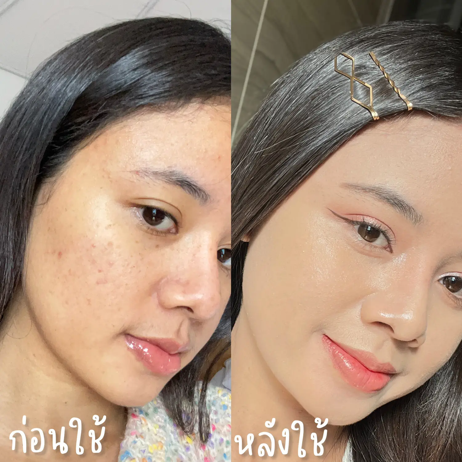 เจอแล้วแป้งที่จริงใจ ! แป้งกลบสิว ! | แกลเลอรีที่โพสต์โดย sixsix | Lemon8