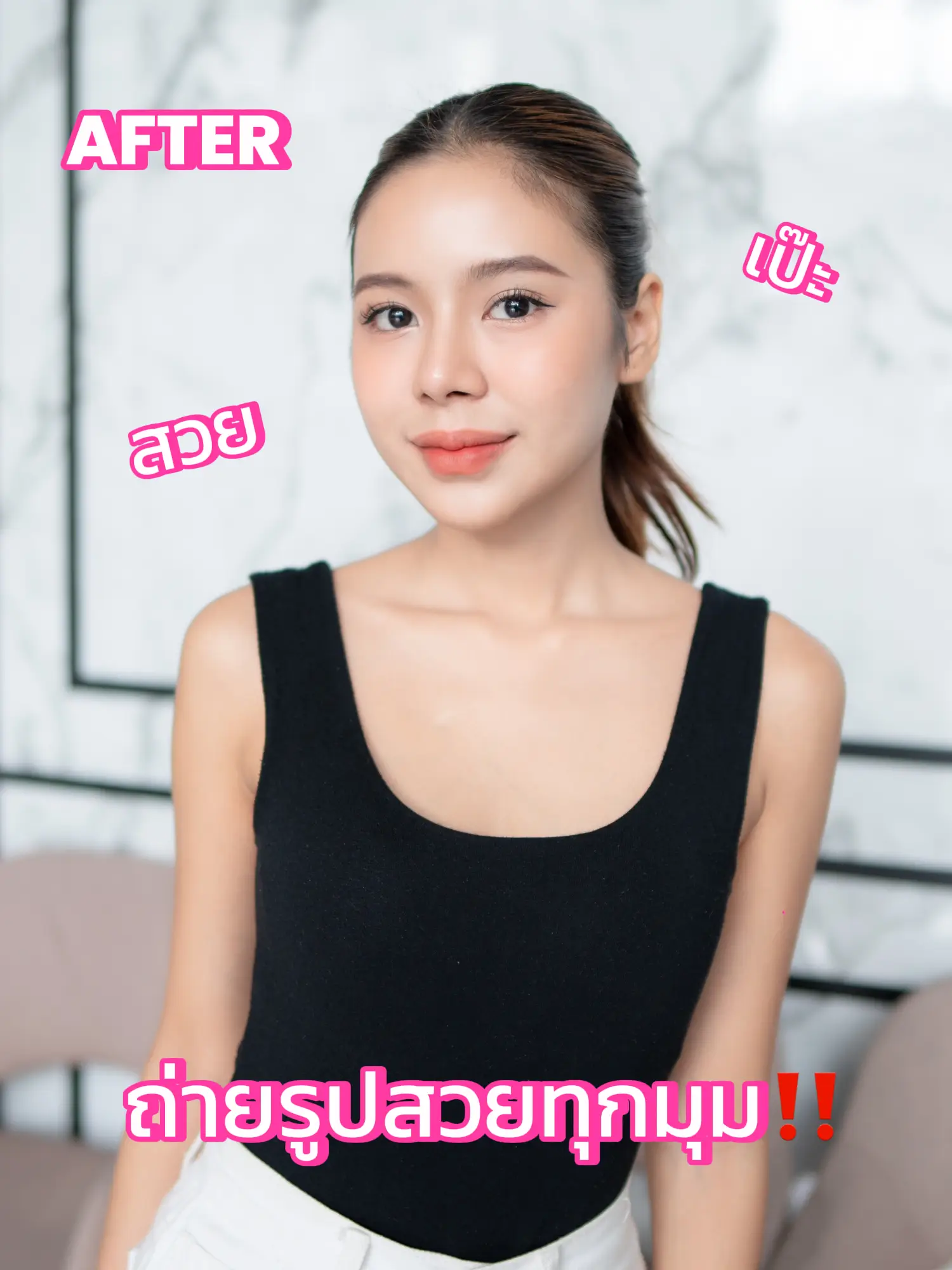 รีวิวฉีด FILLER ขมับครั้งแรกกก ‼️ | แกลเลอรีที่โพสต์โดย GGam Panadda | Lemon8