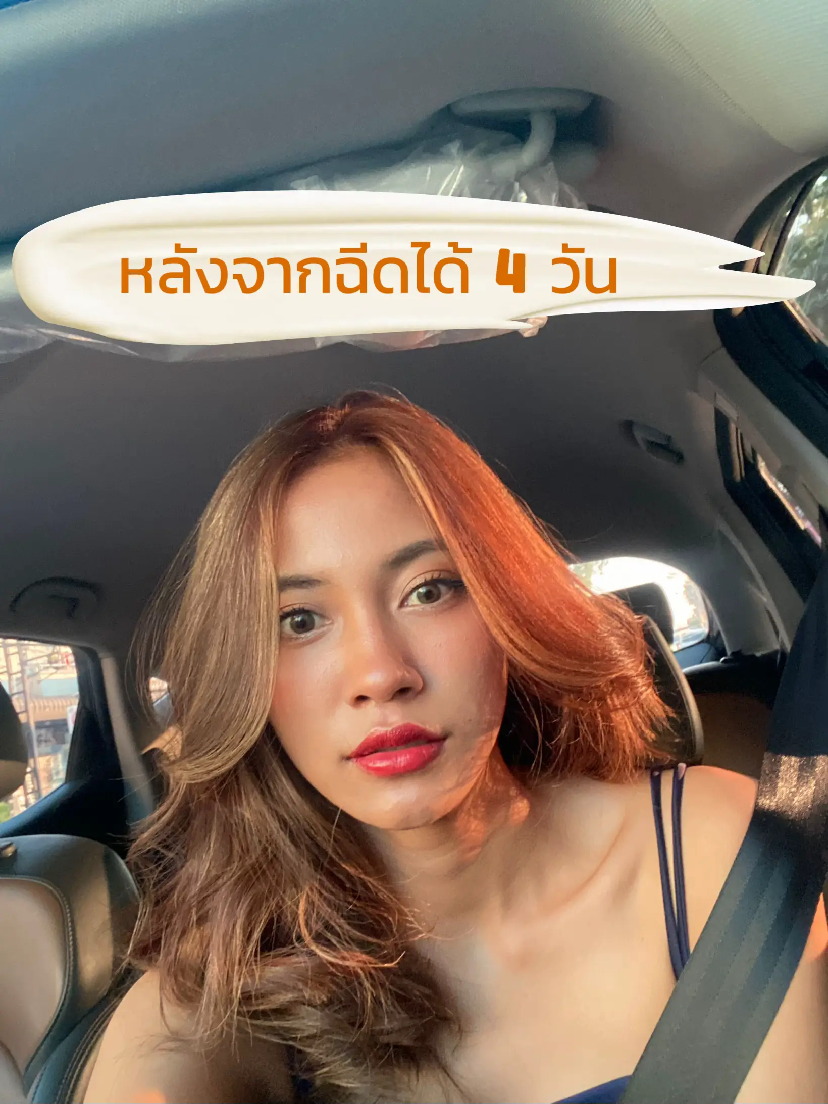 รีวิวฉีดฟิลเลอร์ใต้ตาเเละปาก ฉบับคนฉีดครั้งแรก | แกลเลอรีที่โพสต์โดย Aor Sureeporn | Lemon8