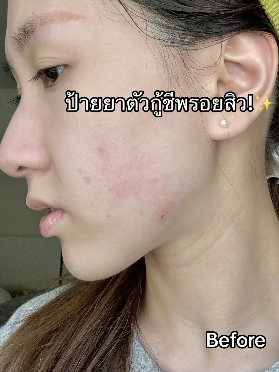 シングルクイックマークを回復し、終了 | Praewpeeradaが投稿したフォトブック | Lemon8