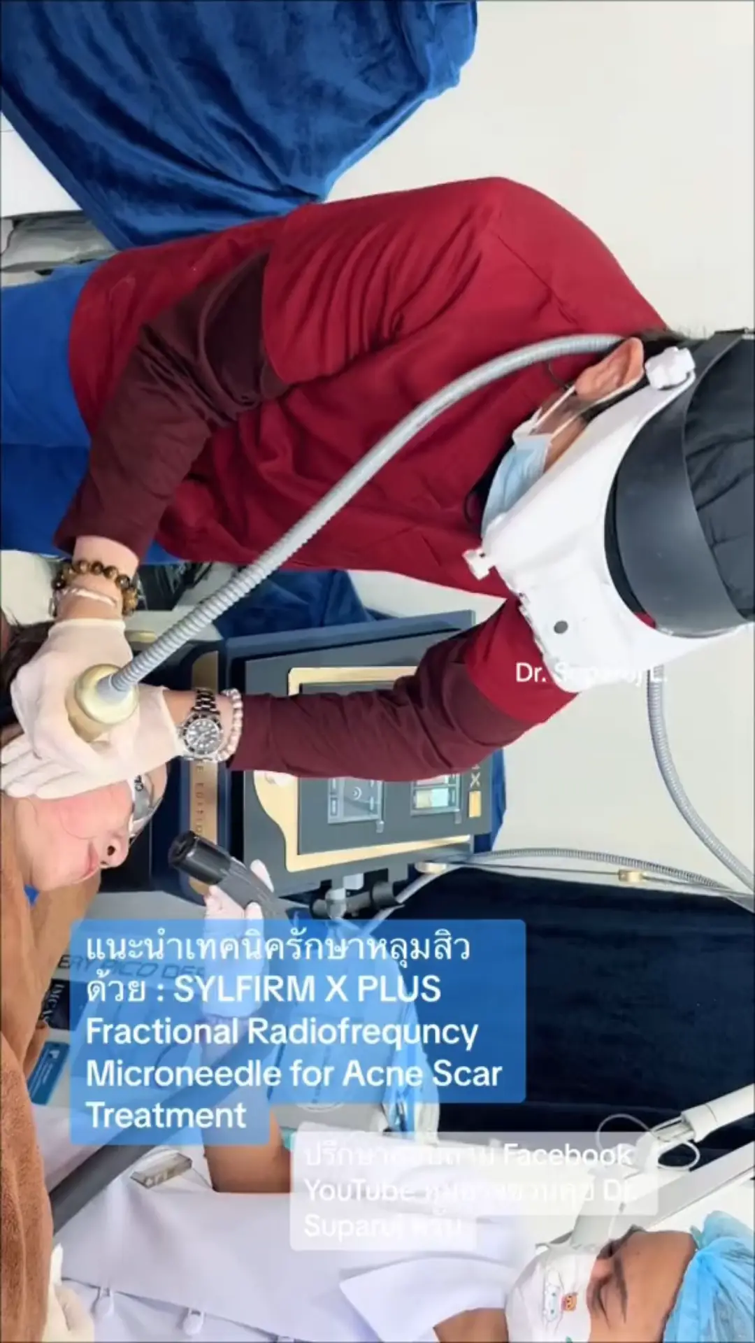 รักษาหลุมสิวด้วย : SYLFIRM X PLUS Fractional RF | วิดีโอที่เผยแพร่โดย หมอรุจชวนคุยRuj | Lemon8