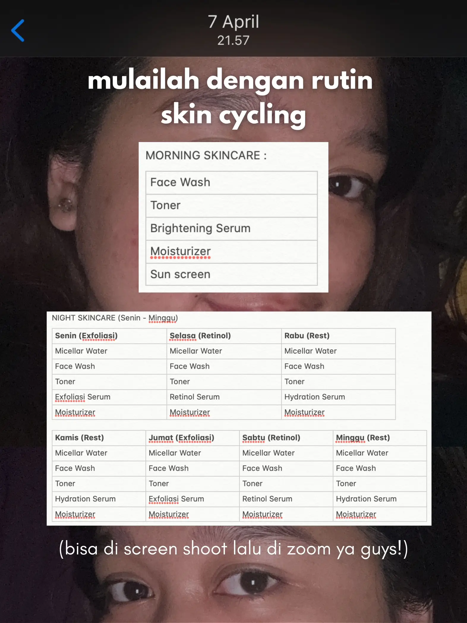 CARA MENGHILANGKAN BEKAS JERAWAT | Galeri diposting oleh tata🐰 | Lemon8