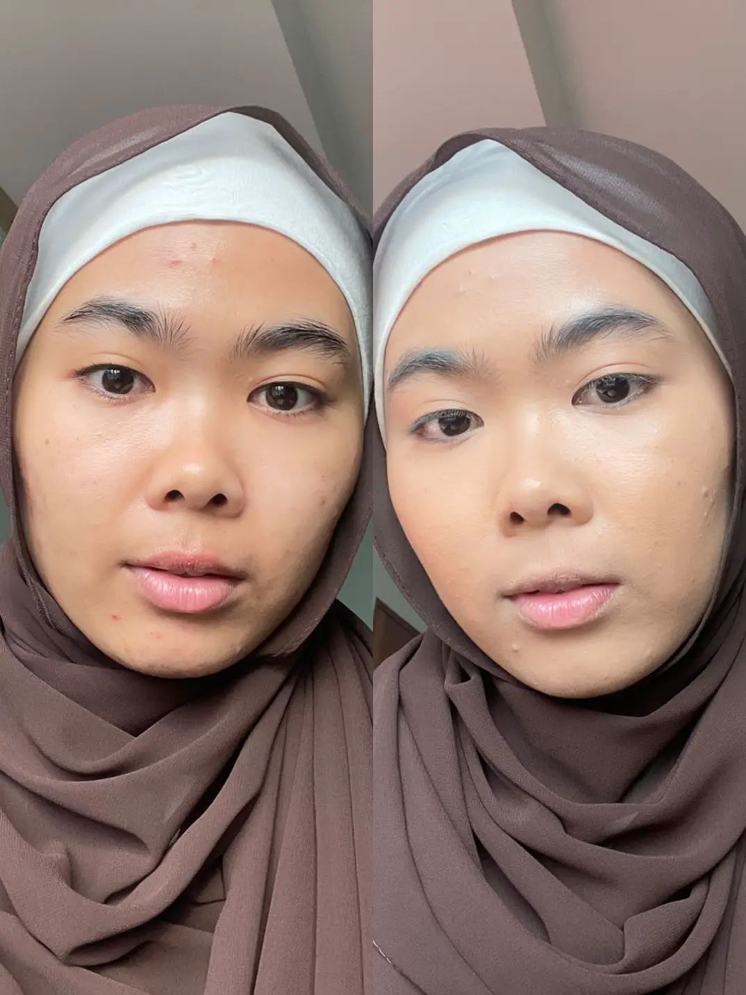 รีวิวคุชชั่น SKINTIFIC | แกลเลอรีที่โพสต์โดย iice.sps | Lemon8