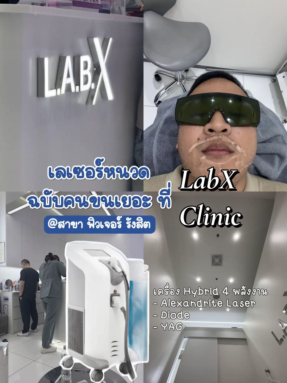 เรเซอร์หนวด @LabX Clinic สาขาฟิวเจอร์รังสิต | แกลเลอรีที่โพสต์โดย Den ...