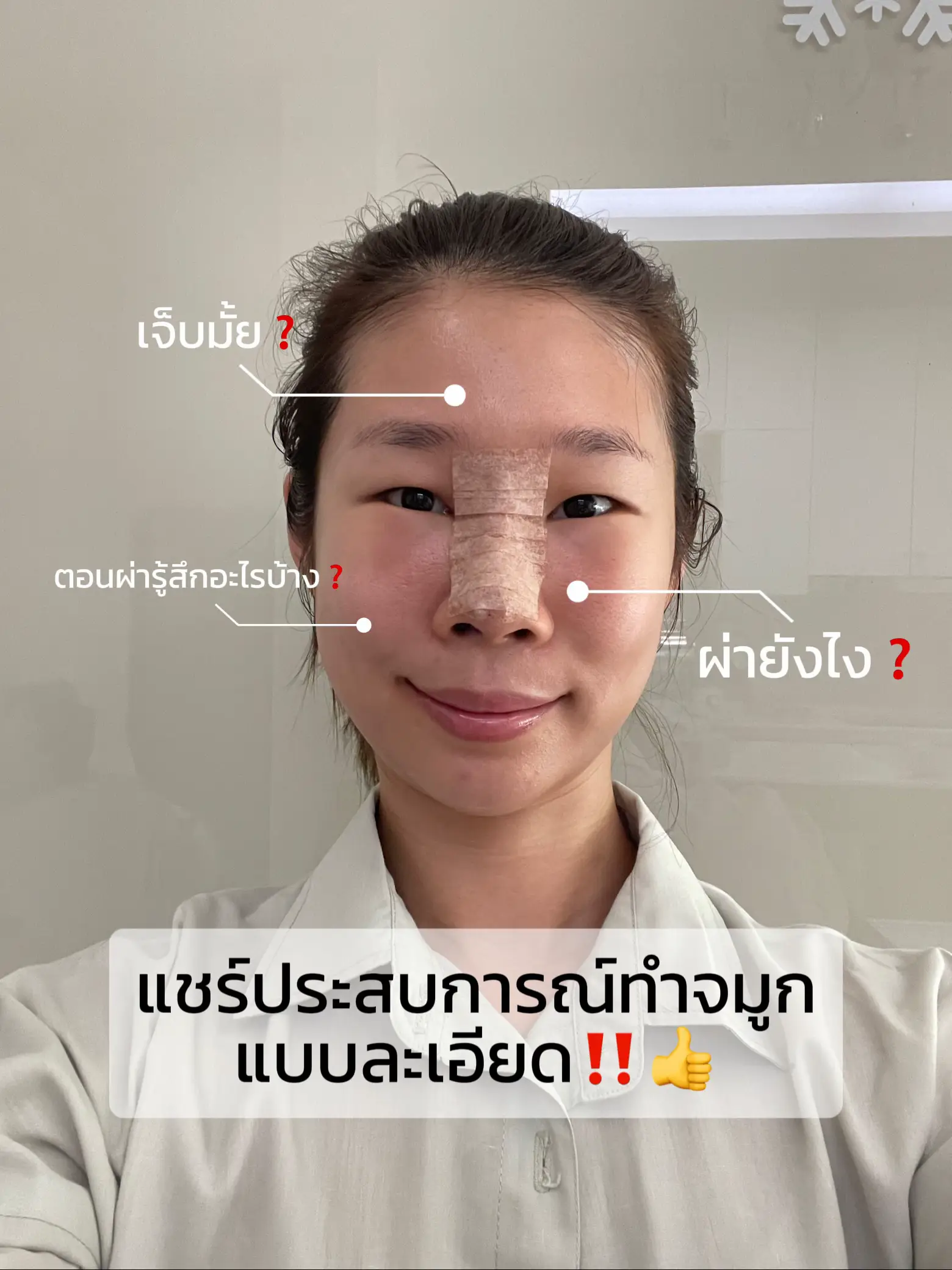 แชร์ประสบการณ์วันผ่าจมูก‼️ | วิดีโอที่เผยแพร่โดย im_papam | Lemon8