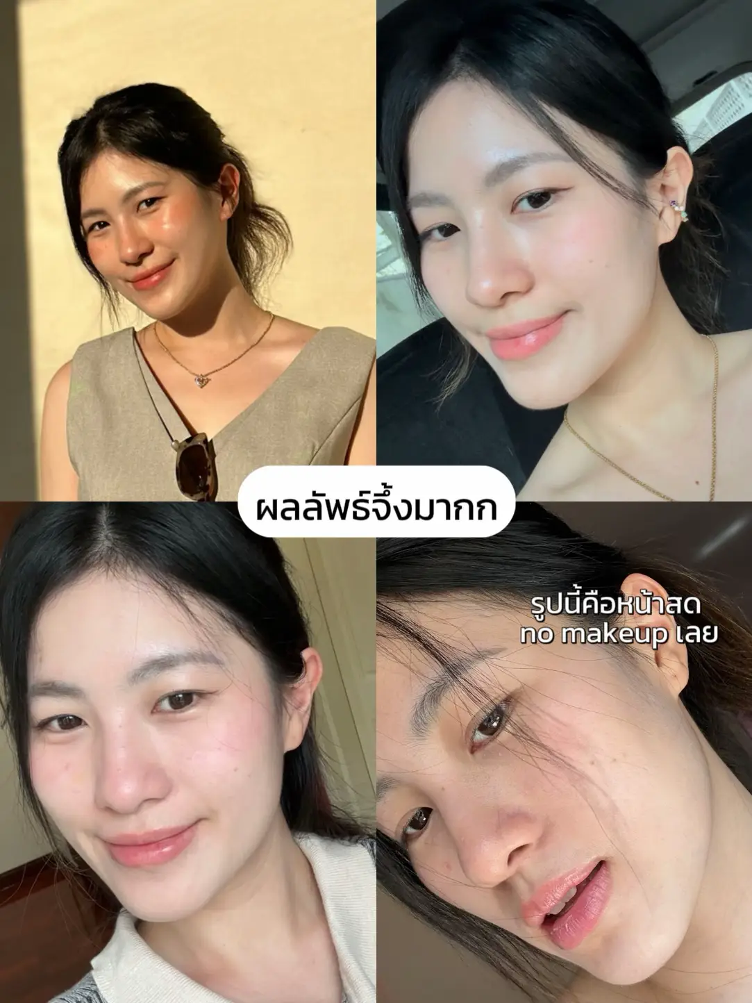 รีวิวฉีดหน้าที่เกาหลีครั้งแรก! 😱 ที่ Vands Clinic | แกลเลอรีที่โพสต์โดย Pearrie bob ツ | Lemon8