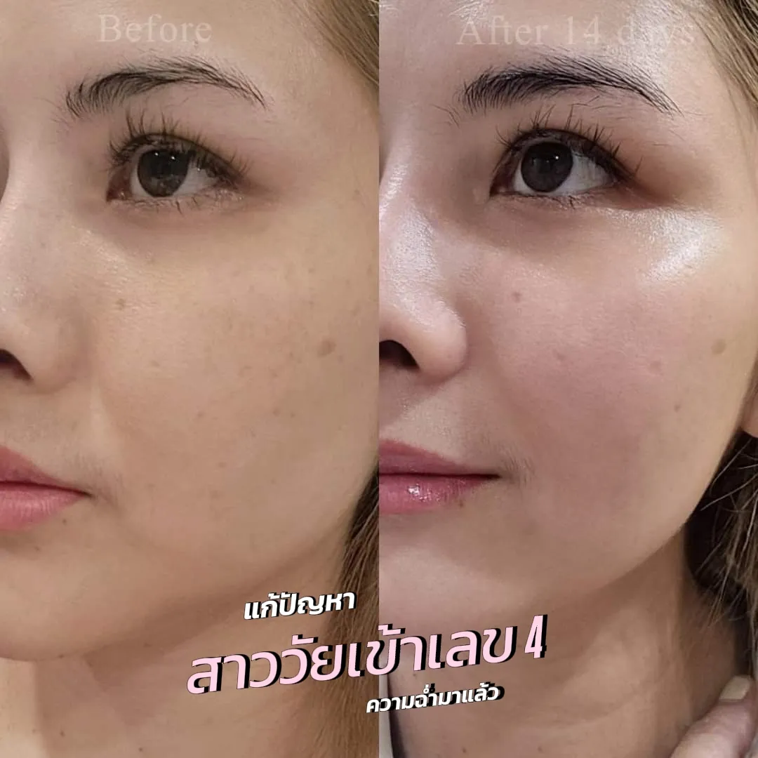 อายุเข้าเลข 4 ต้องกู้ผิว " 𝐕𝐢𝐜𝐡𝐲 𝐋𝐢𝐟𝐭𝐚𝐜𝐭𝐢𝐯 " | แกลเลอรีที่โพสต์โดย Mama Chic chic | Lemon8