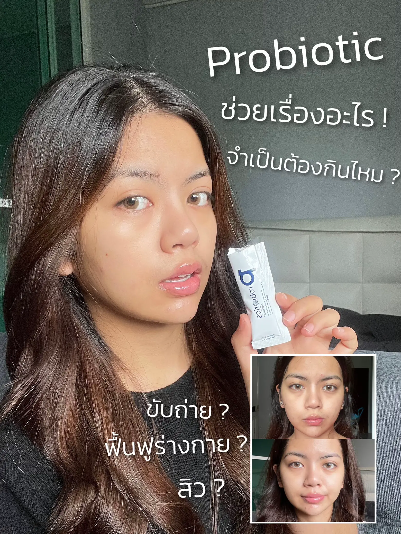 Probiotic ช่วยเรื่องอะไร จำเป็นต้องกินไหม ?! 💡 | แกลเลอรีที่โพสต์โดย Kkacha | Lemon8