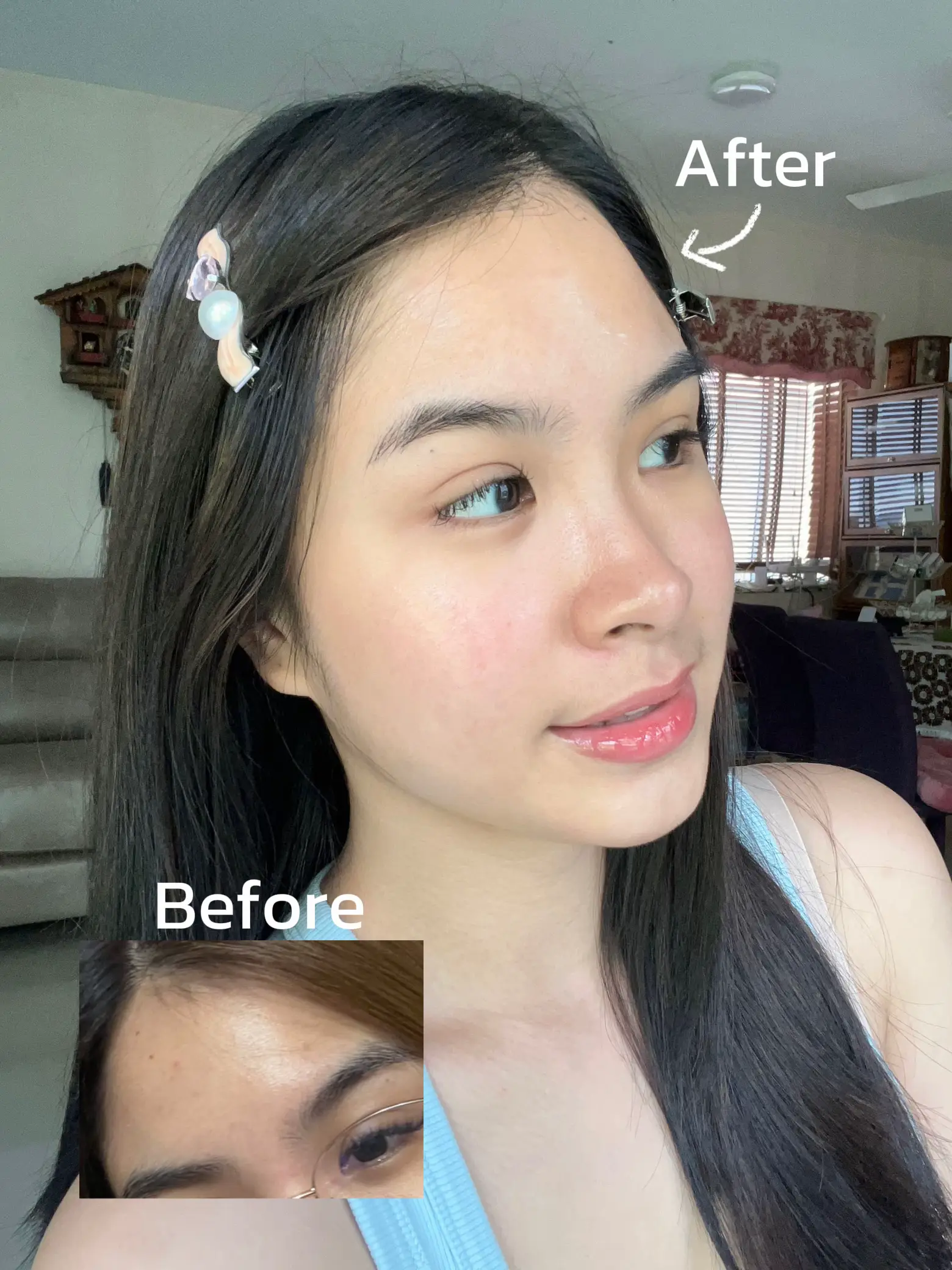 SKINTIFIC moisture gel ใช้ดีมั้ย ตัวไหนเหมาะกับเรา? 🧏🏻‍♀️🩵 | แกลเลอรีที่โพสต์โดย Mya Boonnalin ...