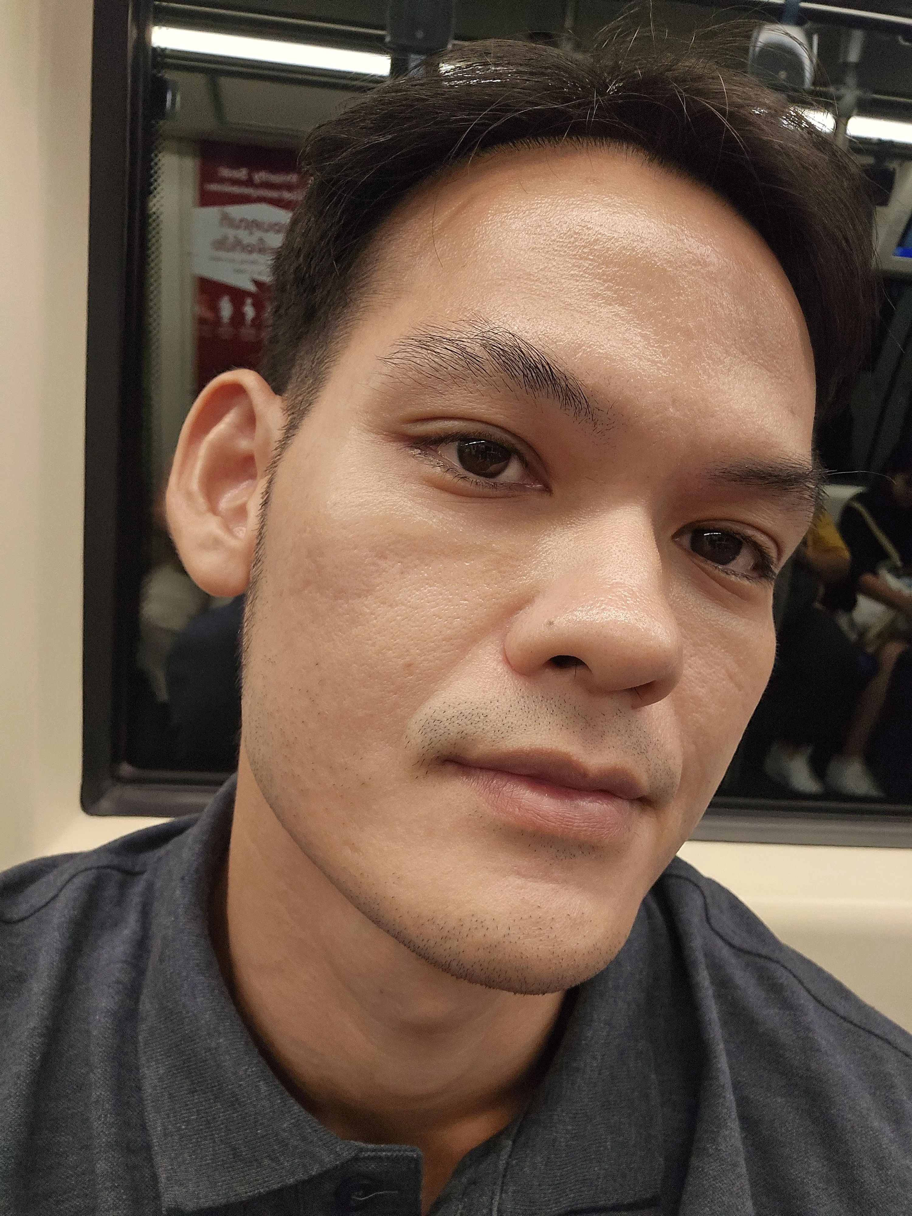 Pico Laser กับหมอต๊ะ ที่ Visage Aesthetic | แกลเลอรีที่โพสต์โดย tootsyreview | Lemon8