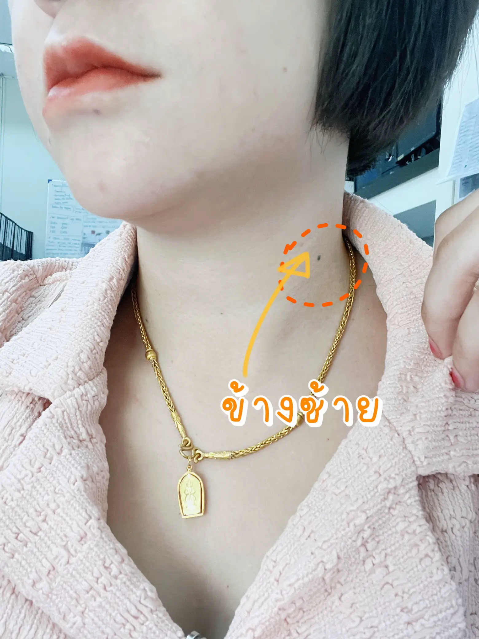 ไฝมหาราณี ขึ้นมาตอนฉัน 32 ขวบ | แกลเลอรีที่โพสต์โดย Ma riam | Lemon8