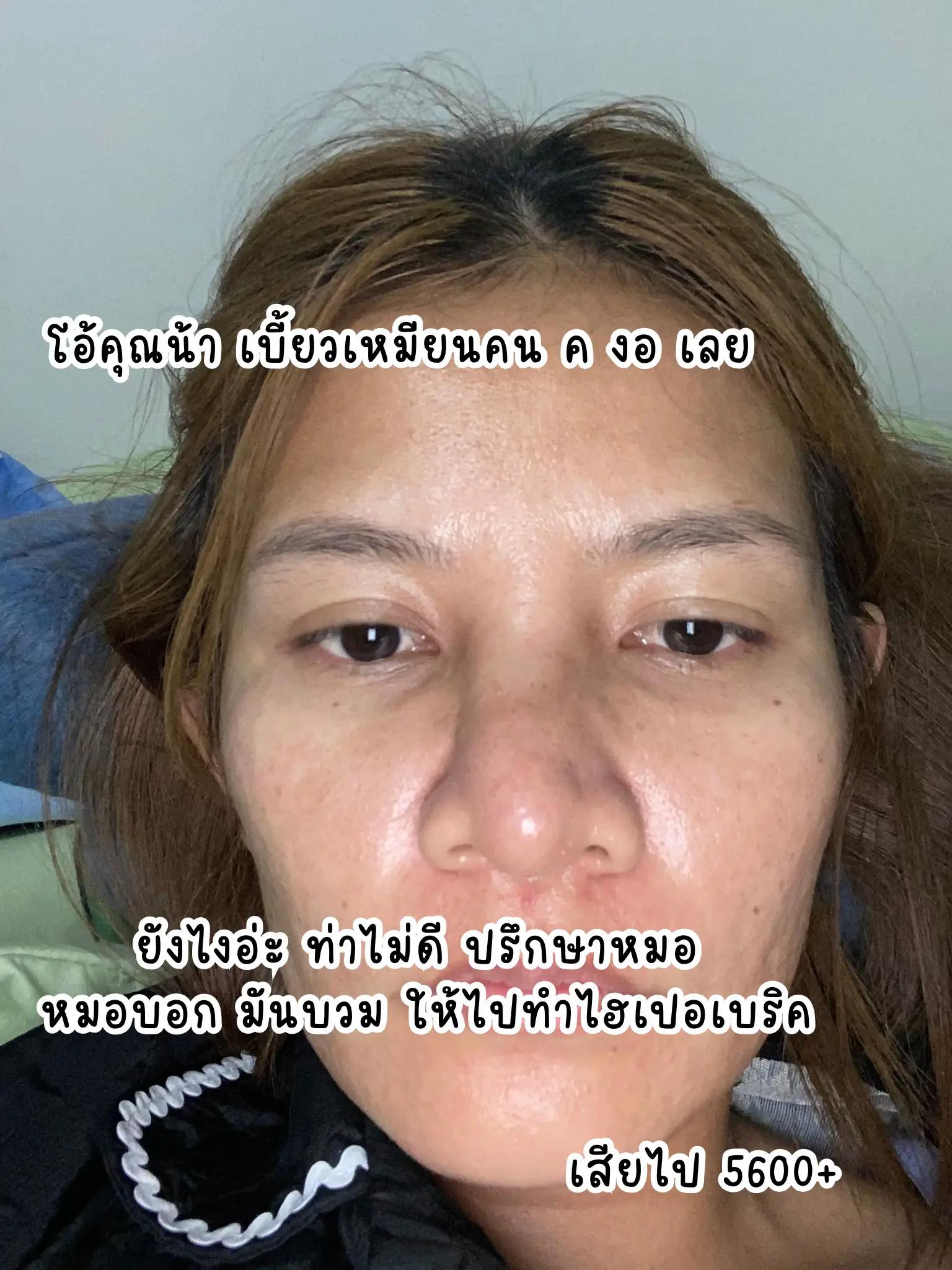 ลดบวม Proctase-P คือ ยา แก้ อะไร - การค้นหาใน Lemon8