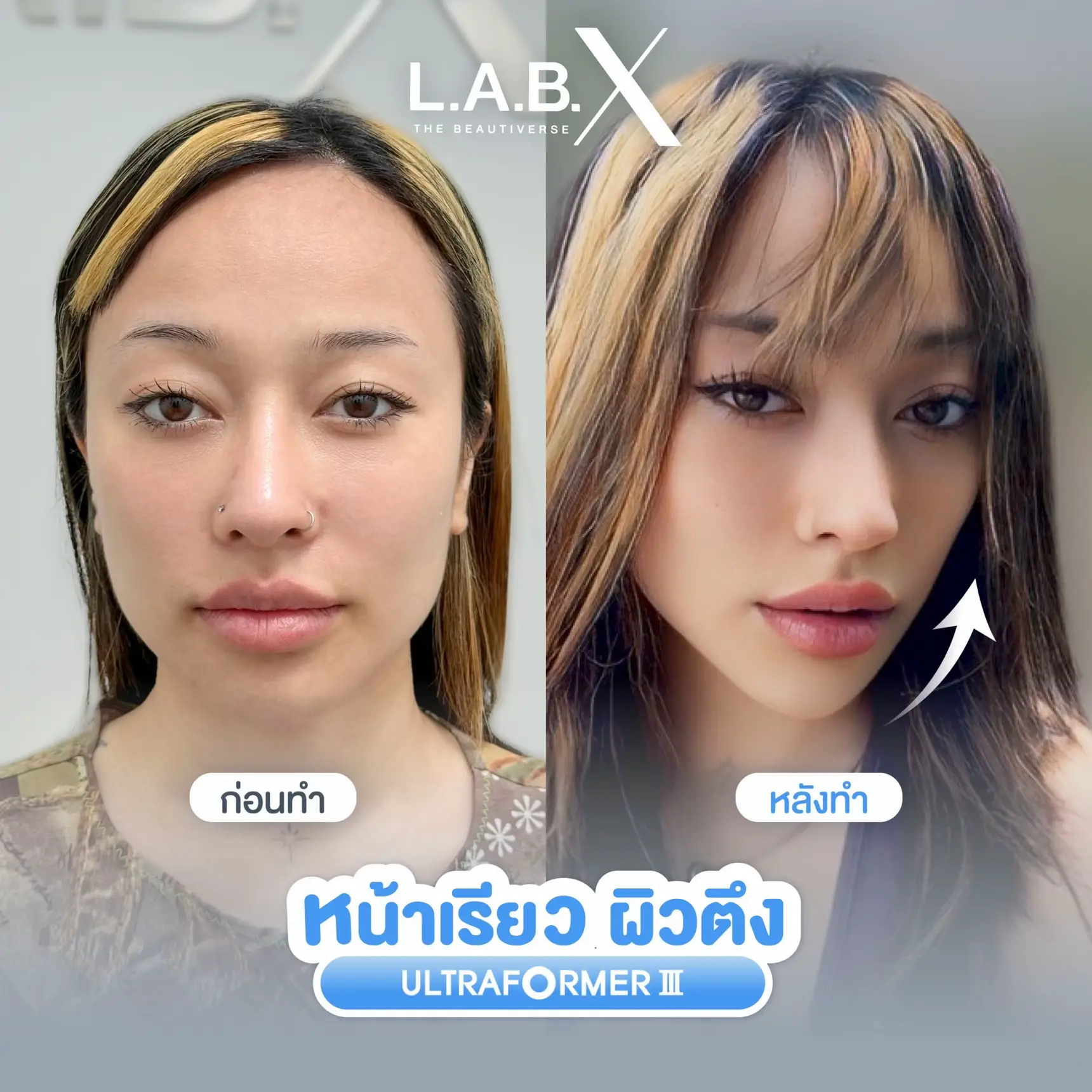 Open the slender face tips that celebrities secretly do! | Gallery ...