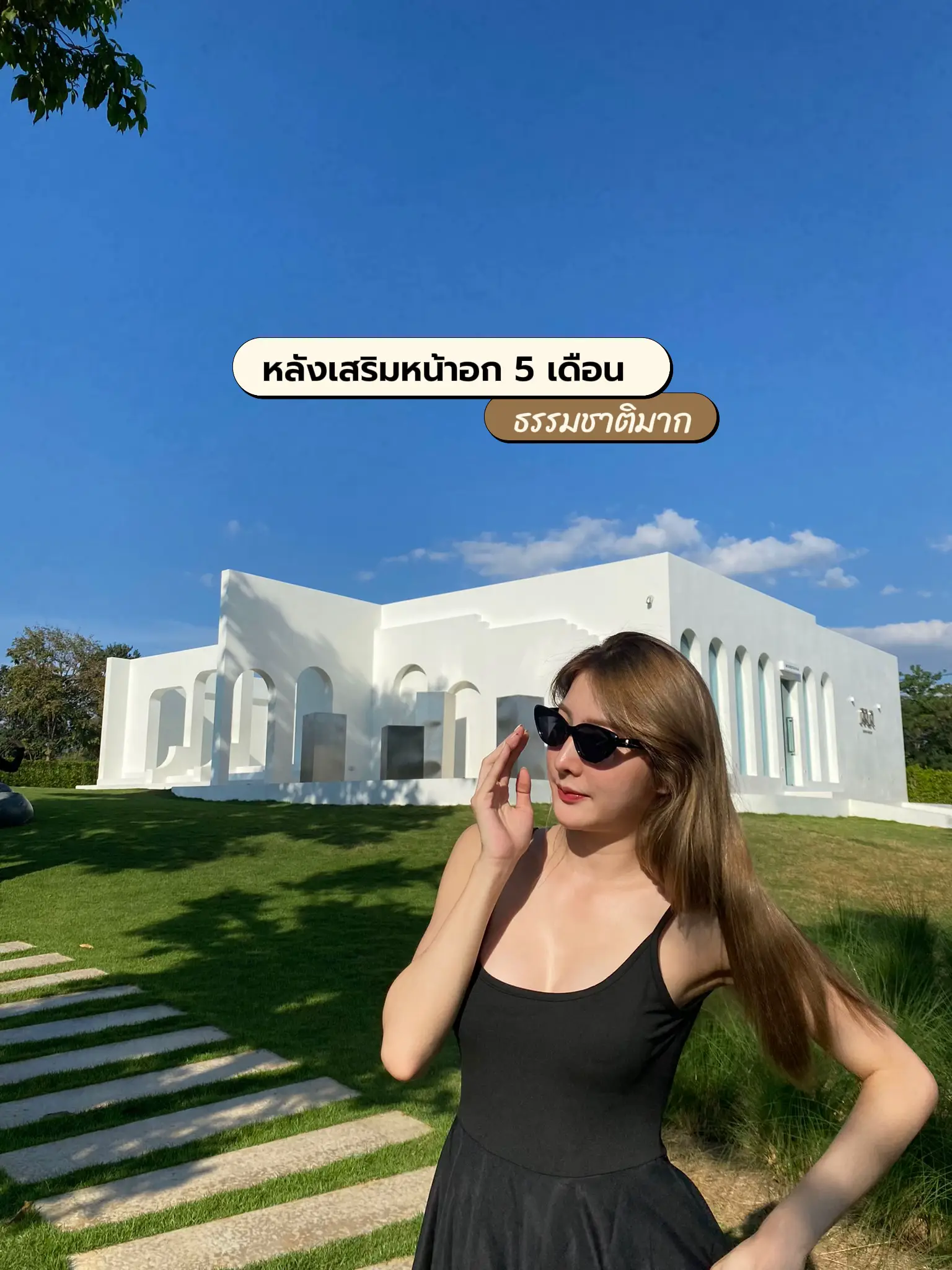 เสริมหน้าอกครั้งแรกปังหรือพัง 🍼 | แกลเลอรีที่โพสต์โดย Jutha | Lemon8