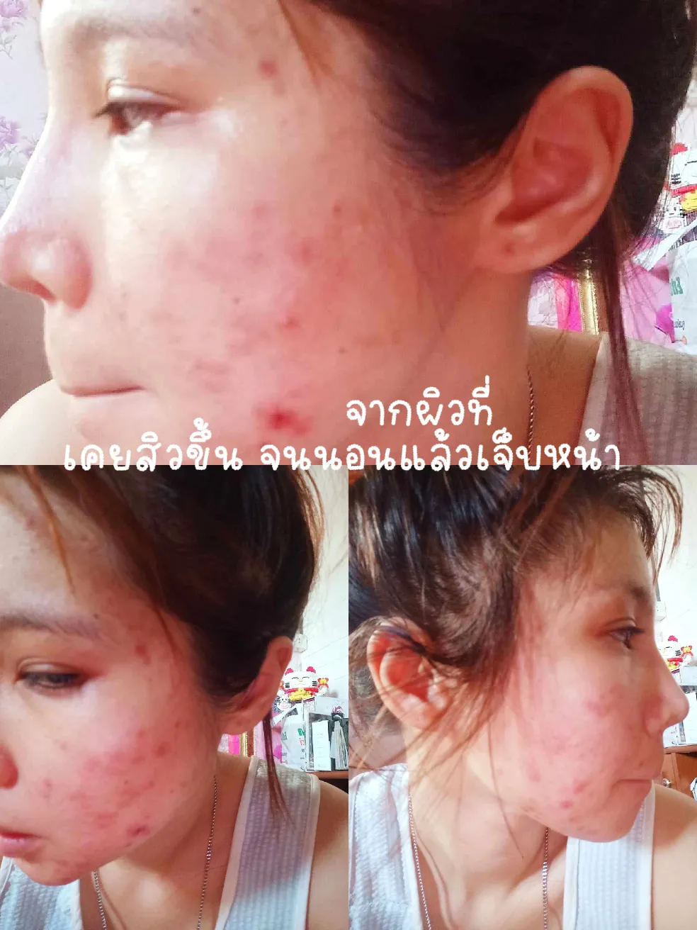 มาร์คหลัก 10 ทำผิวหน้าดีขึ้นจริงหรอ | แกลเลอรีที่โพสต์โดย arada.c 😺 ...