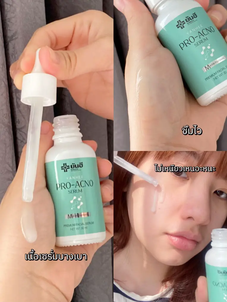 How to รักษาสิวกู้หน้าพัง ด้วยเซรั่ม “ยันฮี”🔍 | แกลเลอรีที่โพสต์โดย cherry 🍒 | Lemon8