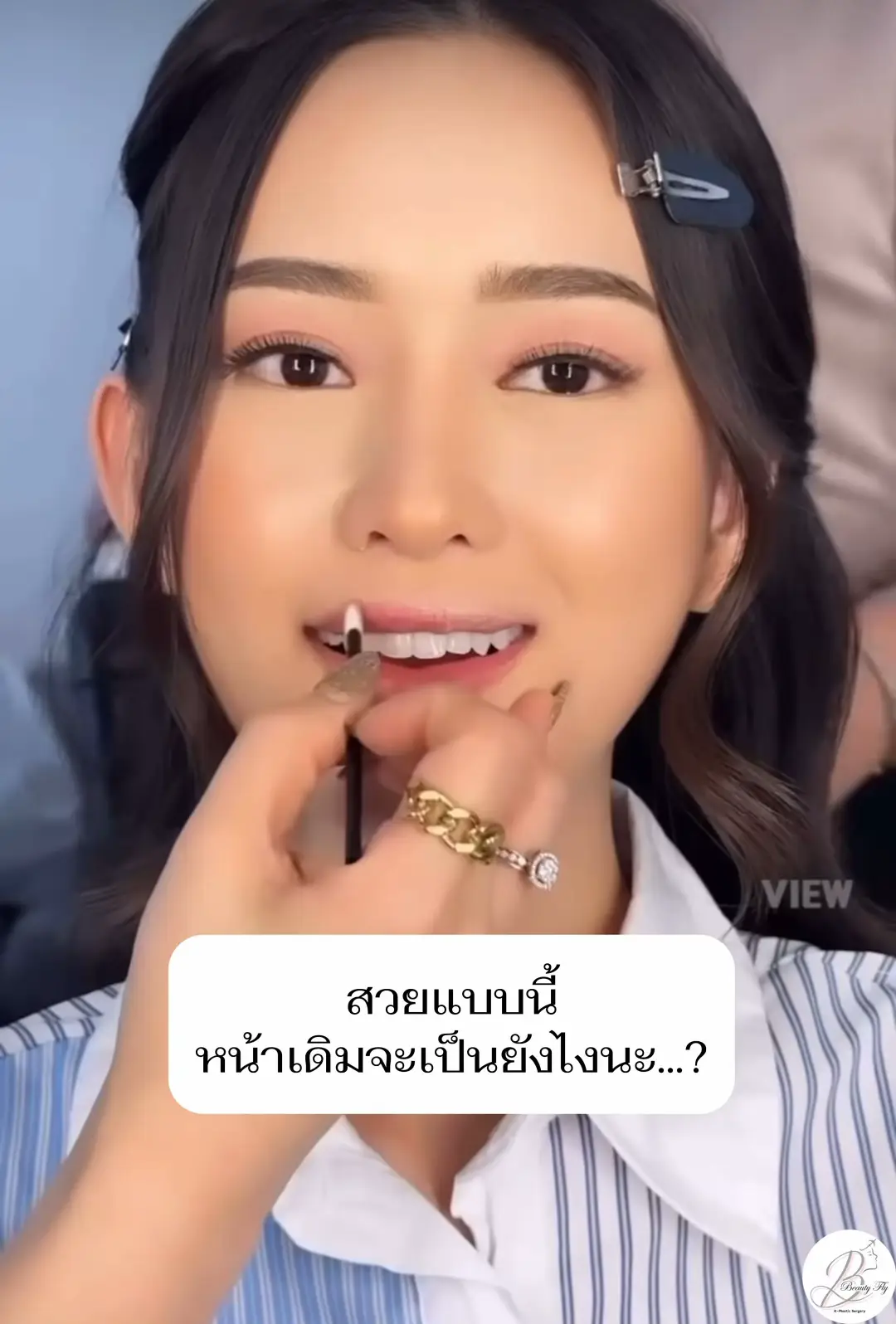 この元の顔はどれくらい美しいですか?#とても美しい#手術#手術レビュー | Noom BTFの投稿動画 | Lemon8